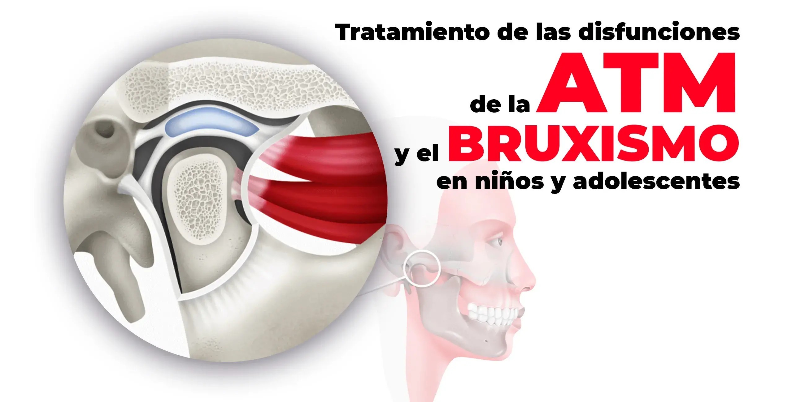 Protocolo de estudios Radiograficos en pacientes con disfunción de ATM