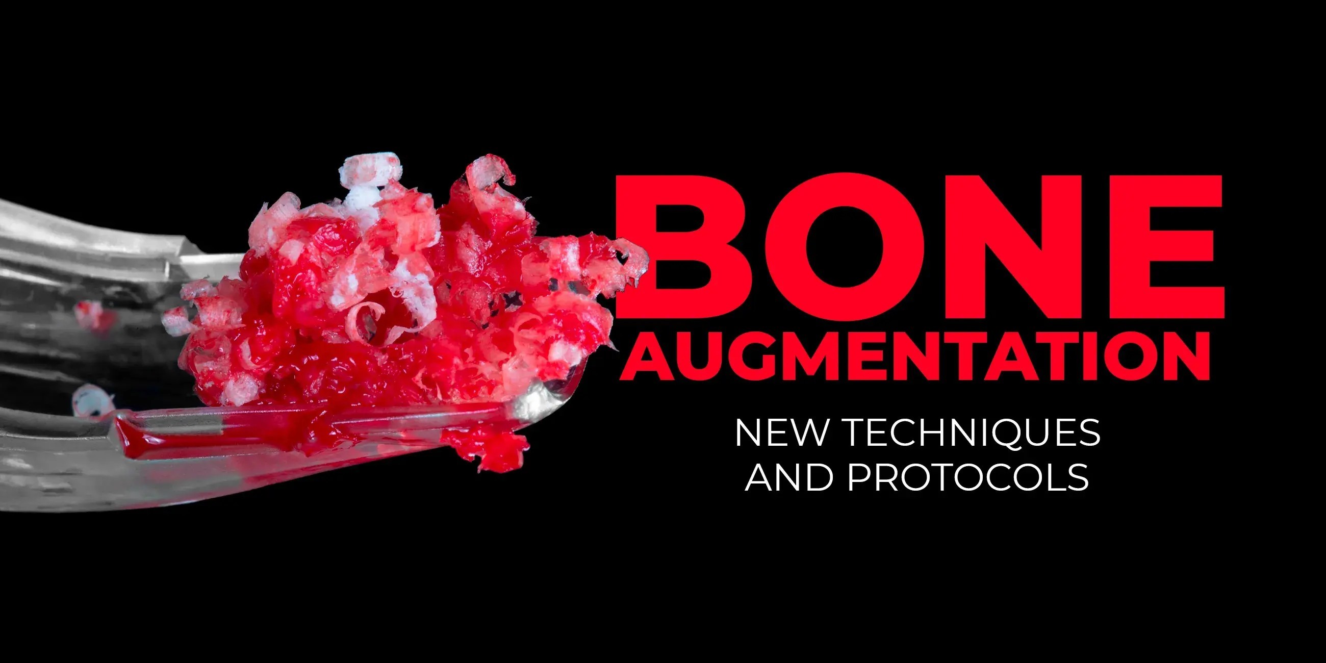Webinar on 3D vertical bone augmentation, membrane selection