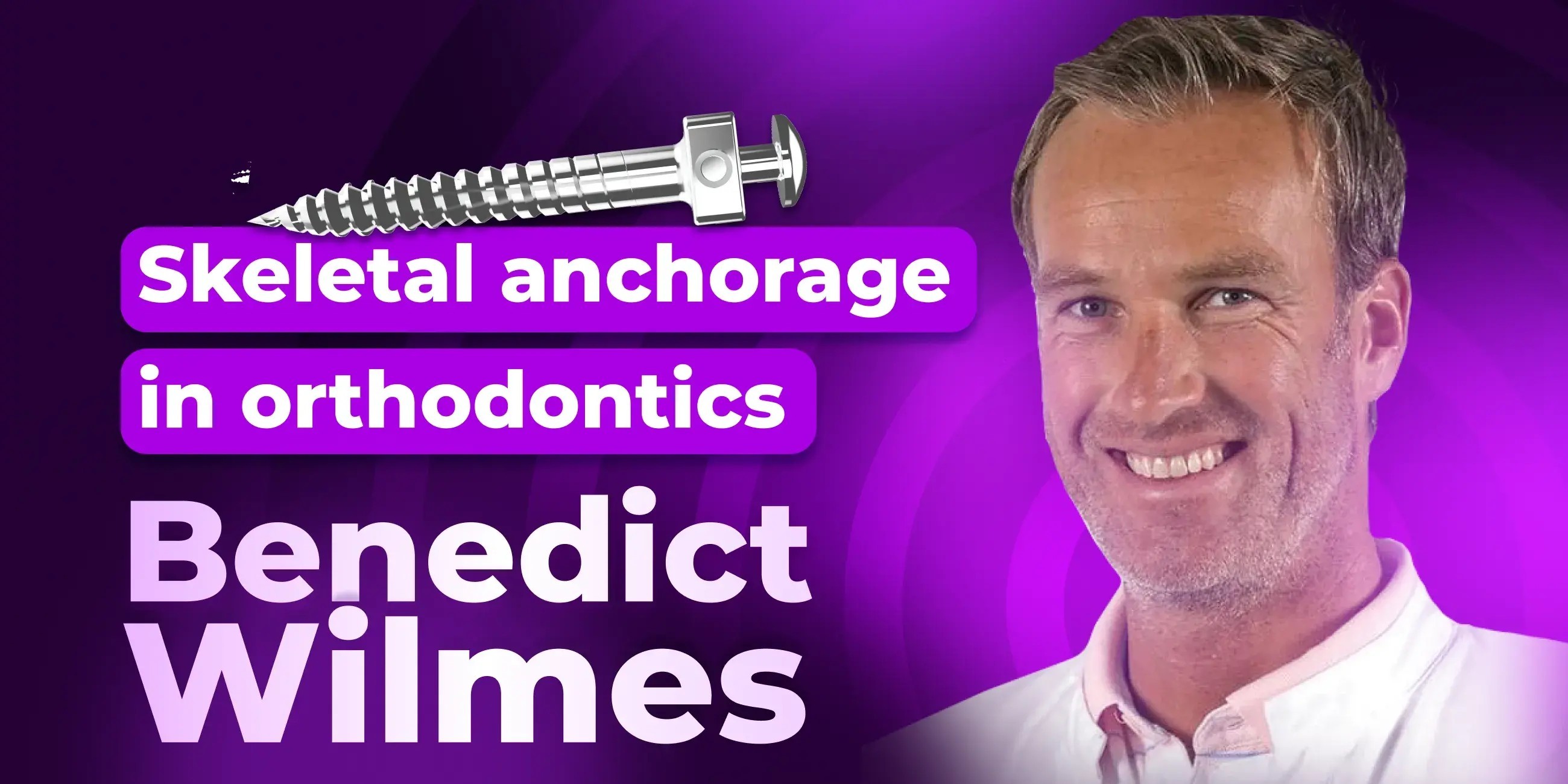Webinar on non-compliant molar mesialization, mini-implants