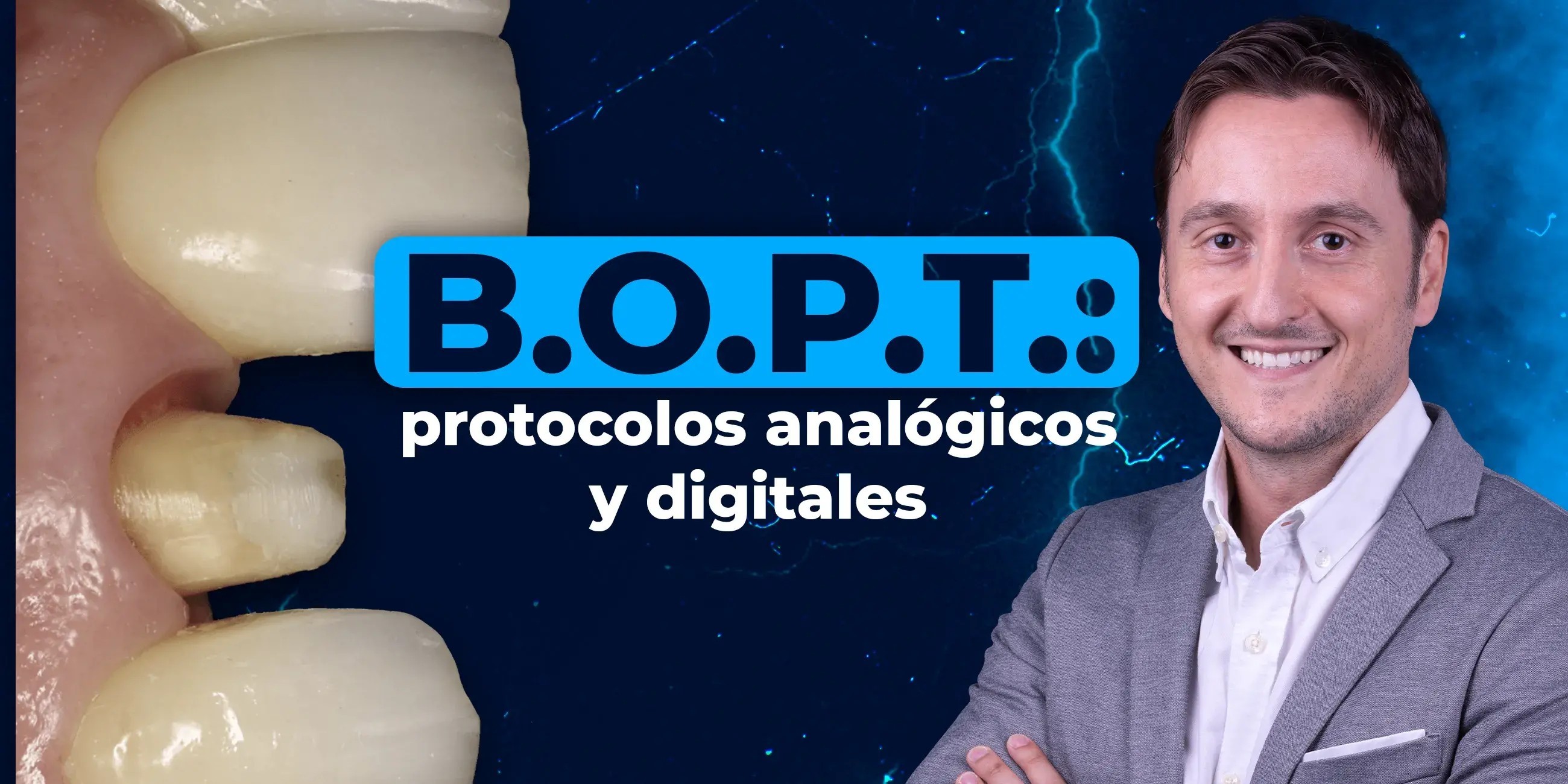 Protocolo clínico de la técnica BOPT. Confección de la prótesis provisional