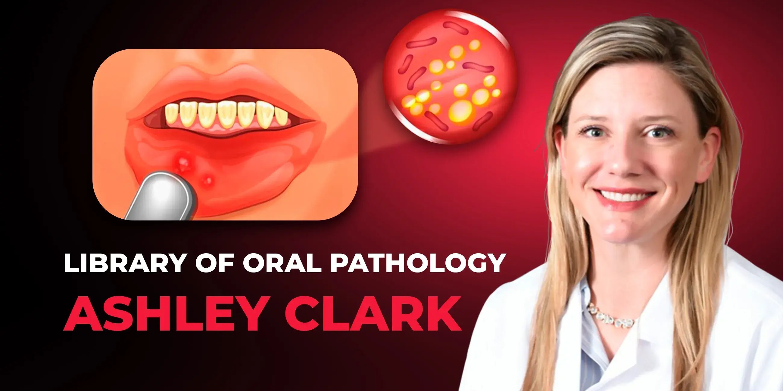 Common radiographic oral pathology