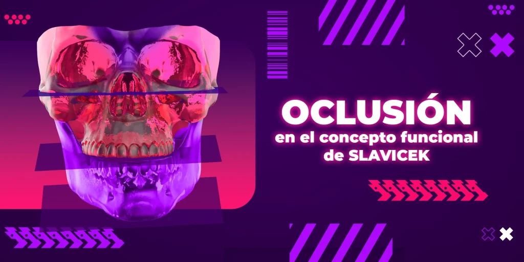 Características de la oclusión Clase 3 de Angle