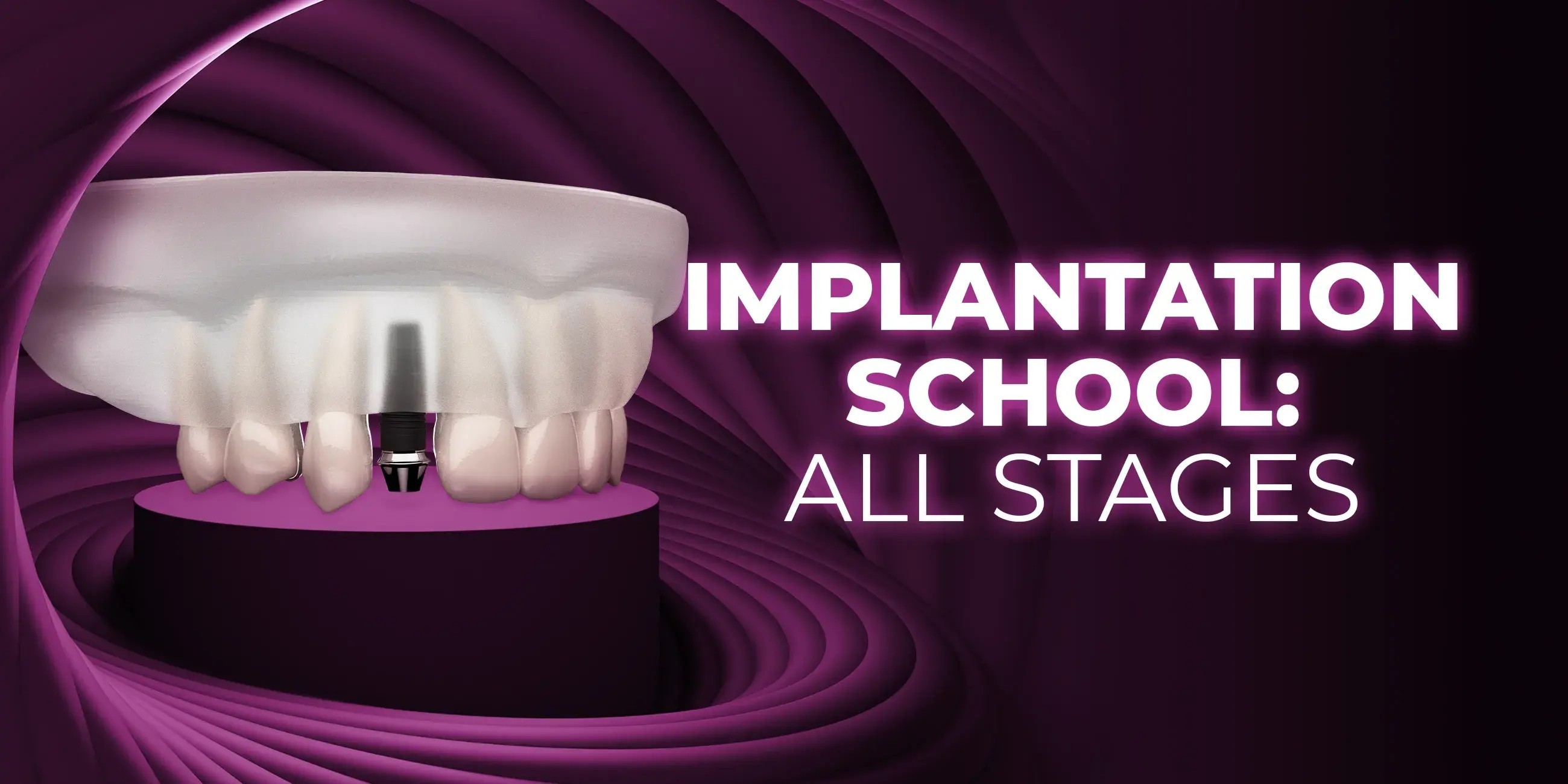 Webinar on post-op care, compliance and implant maintenance