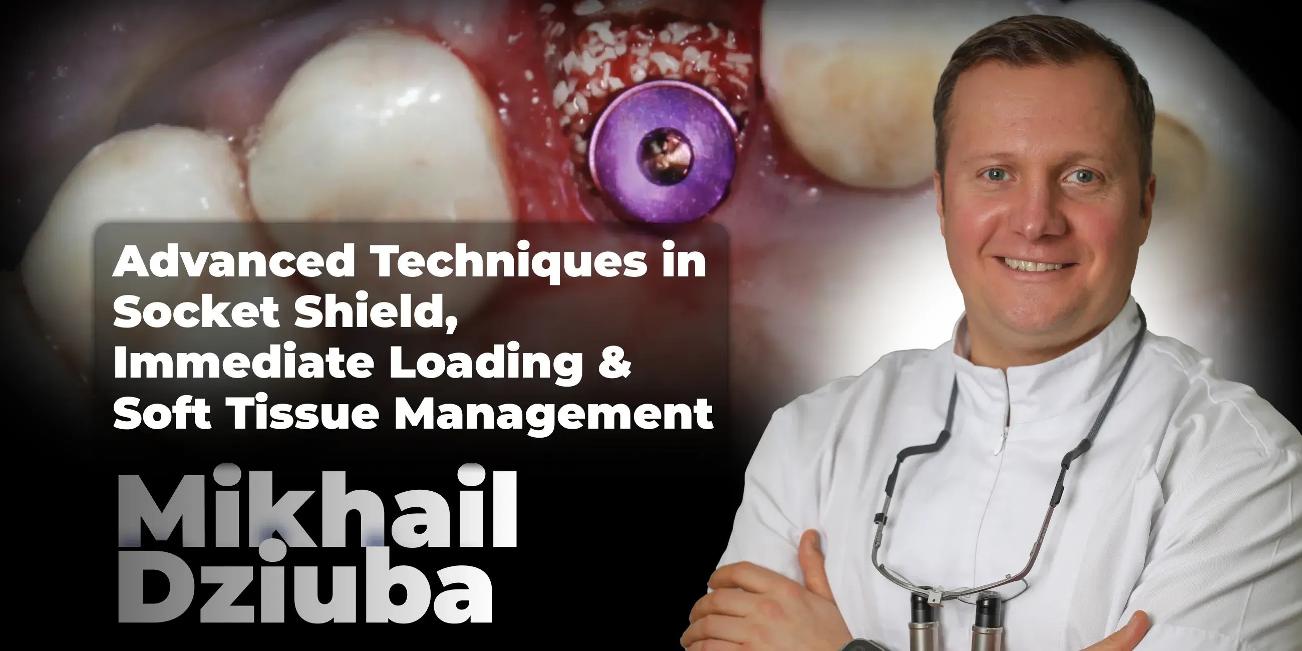 Advanced Techniques in Socket Shield, Immediate Loading & Soft Tissue ...