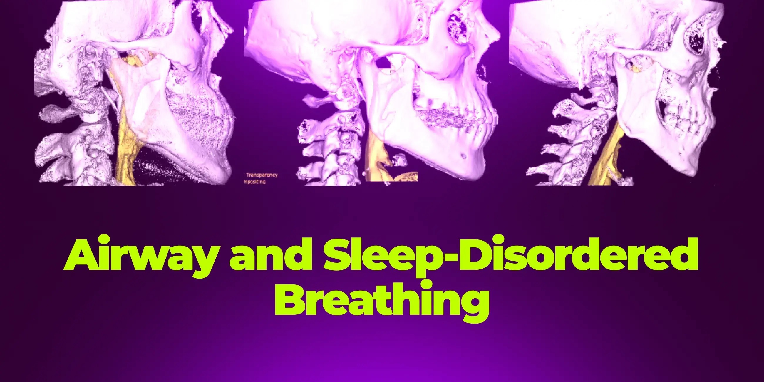 Airway and Sleep-Disordered Breathing: Integrating Myofunctional Protocols