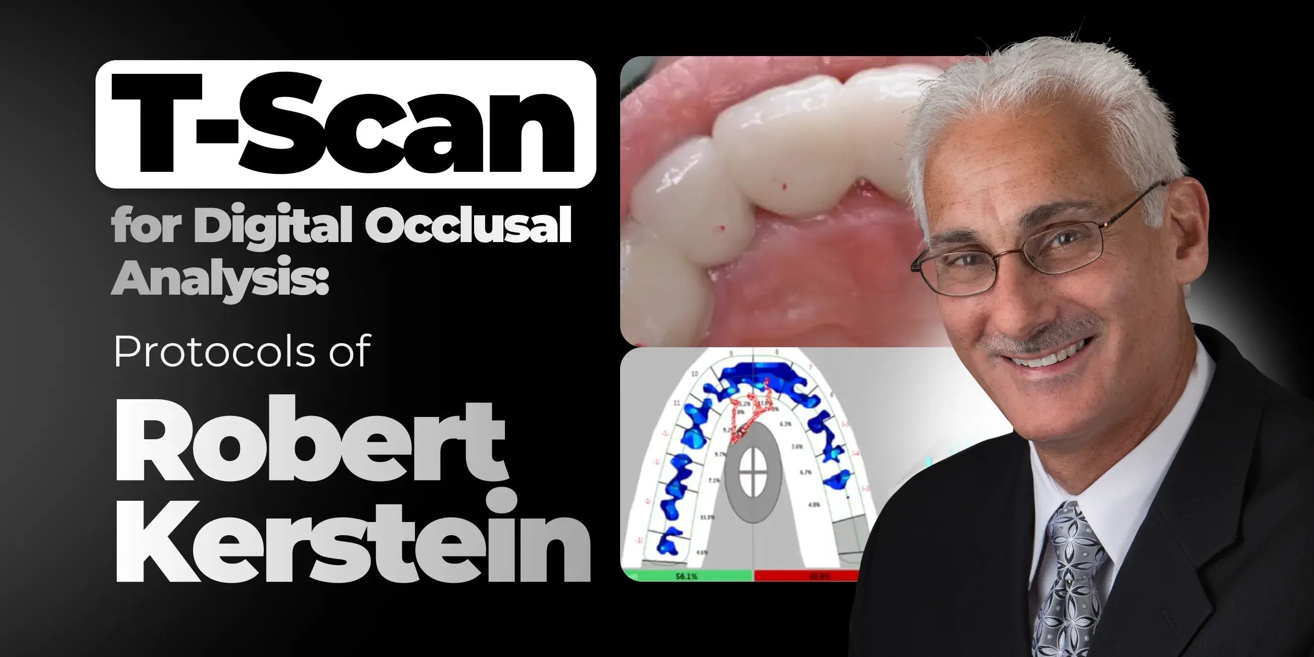 T-Scan™ Recording Procedures: Occlusal Force and Timing Analysis