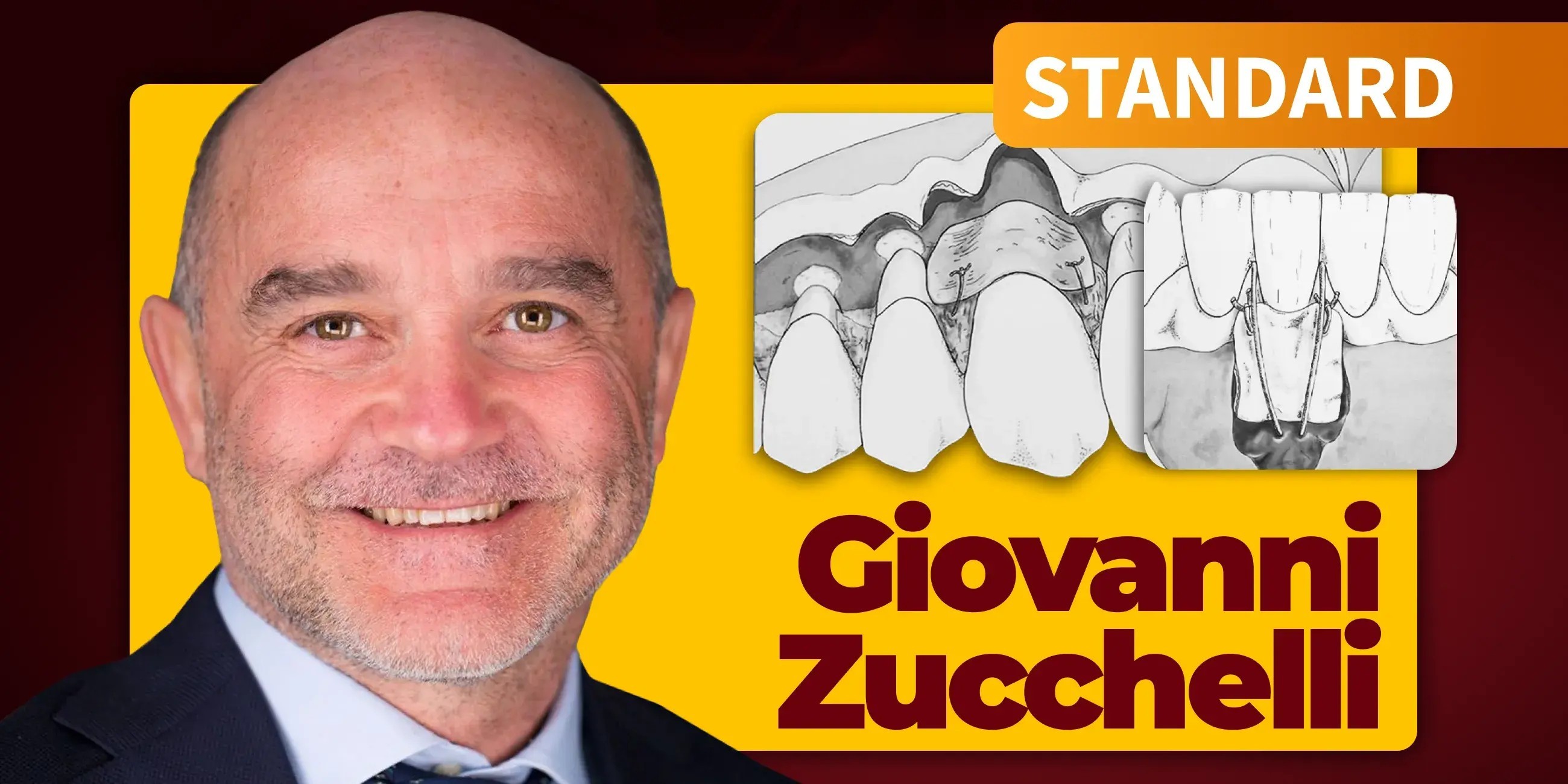 Seminar by Giovanni Zucchelli: Advanced Techniques and Management of ...