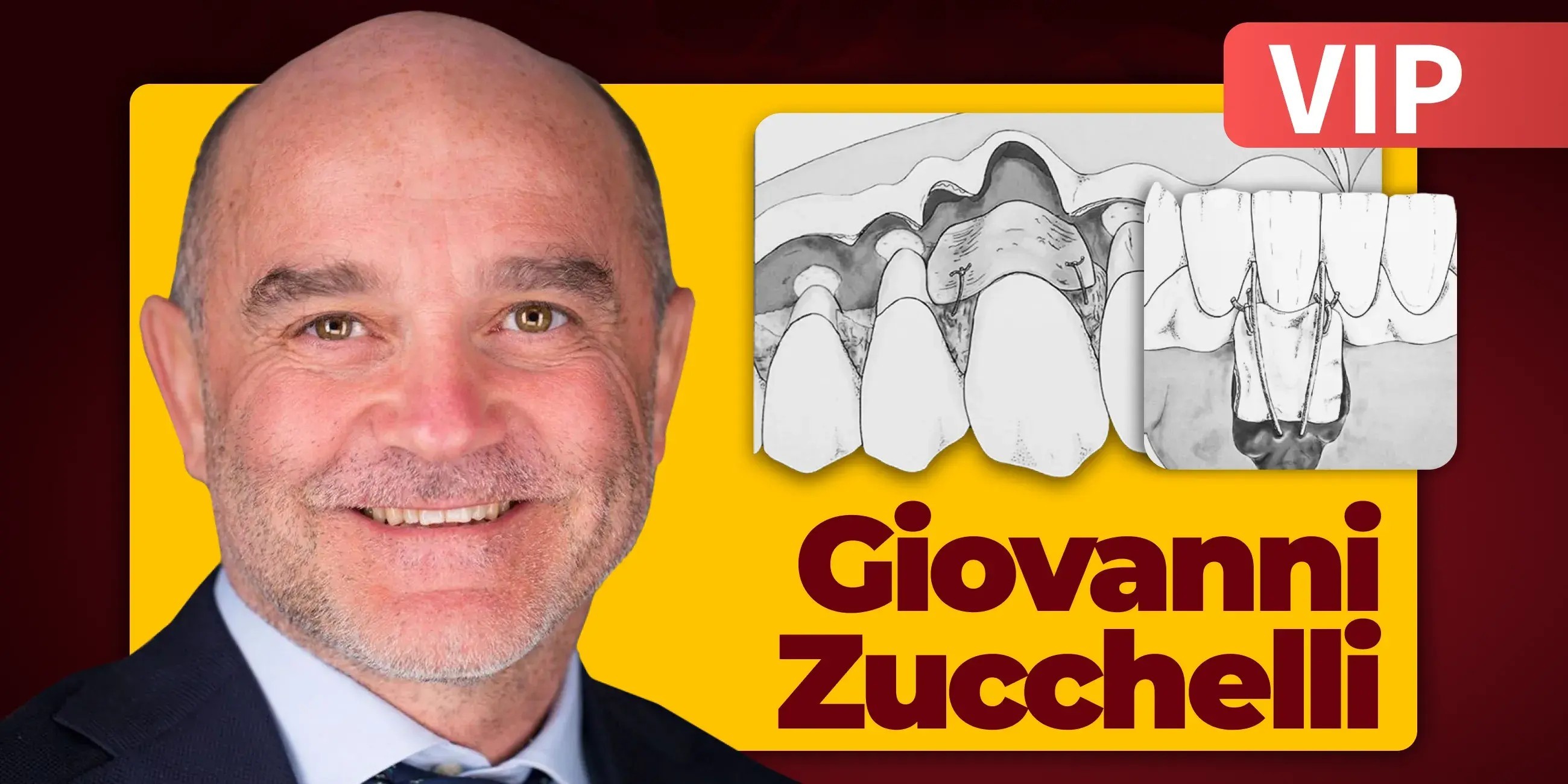 Seminar by Giovanni Zucchelli: Advanced Techniques and Management of ...