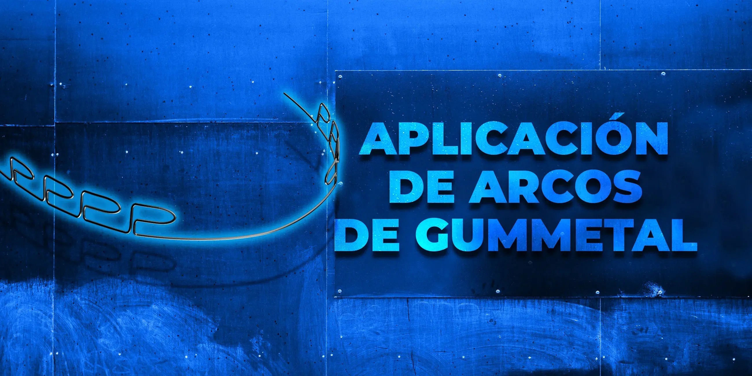 Arcos Gummetal y sus caracteristicas biomecanicas