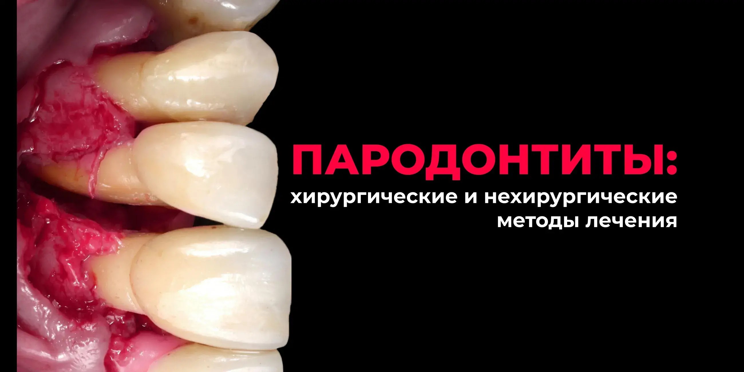 Введение. Клинические рекомендации: нехирургические и хирургические ...