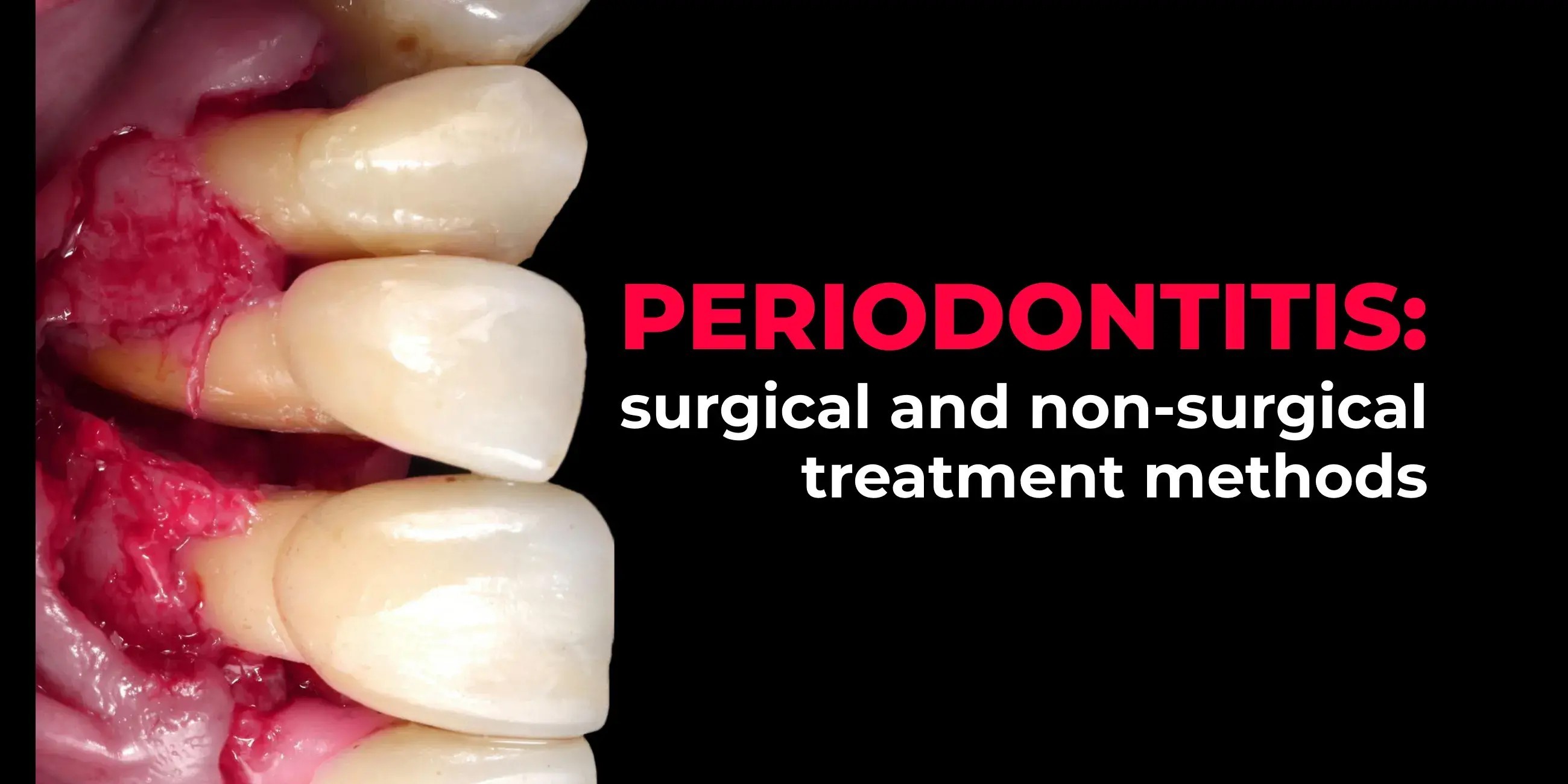 Introduction. Clinical practice guidelines: non-surgical and surgical ...