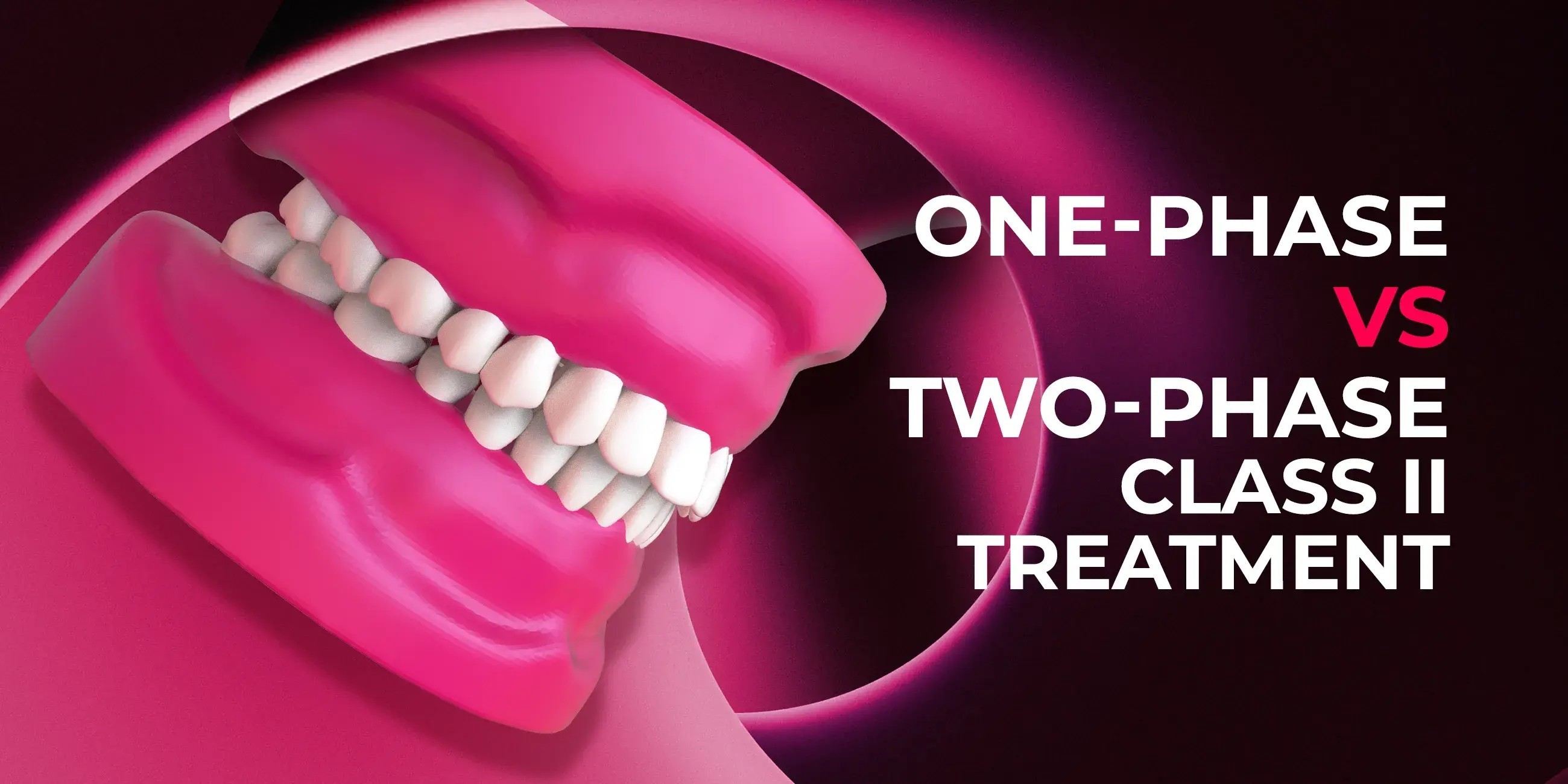 Two steps Class 2 correction in growing patients, webinar