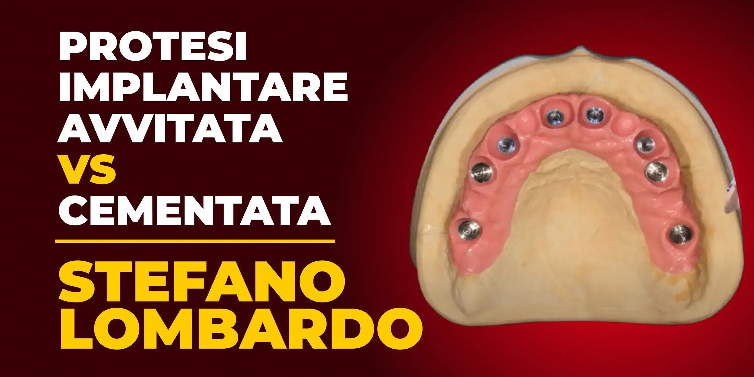 Protesi fissa su denti naturali e impianti