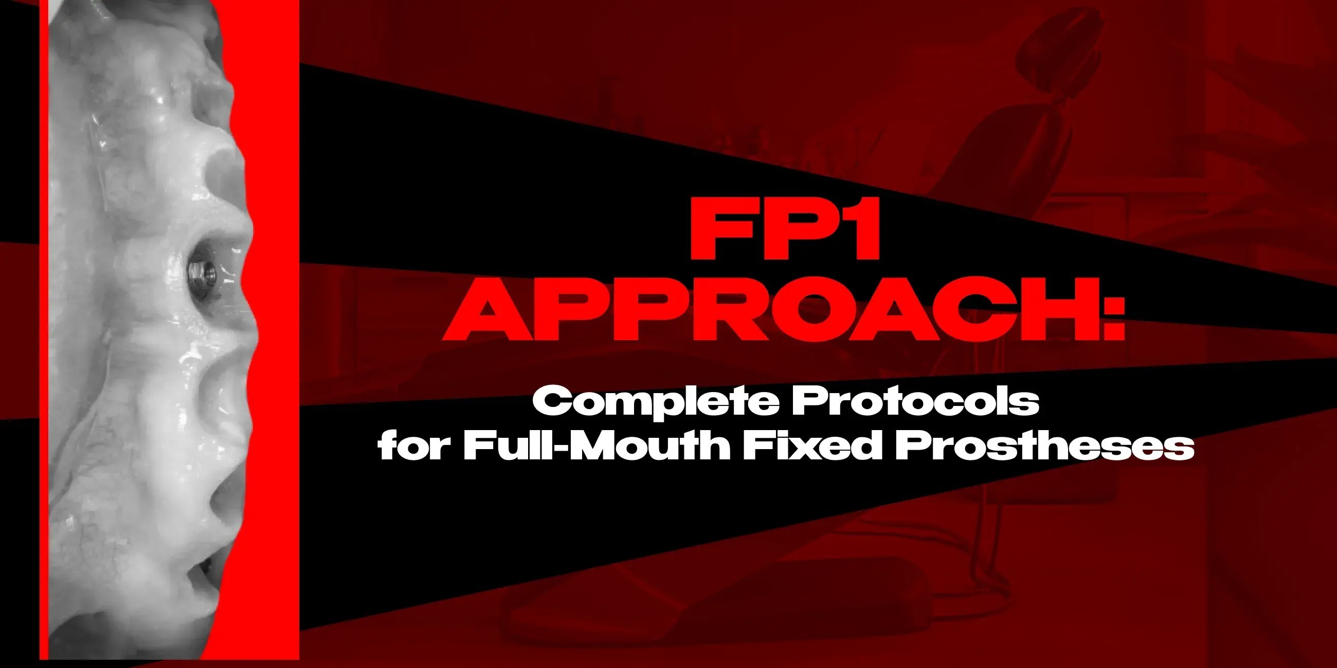 FP1 Approach: Complete Protocols for Full-Mouth Fixed Prostheses