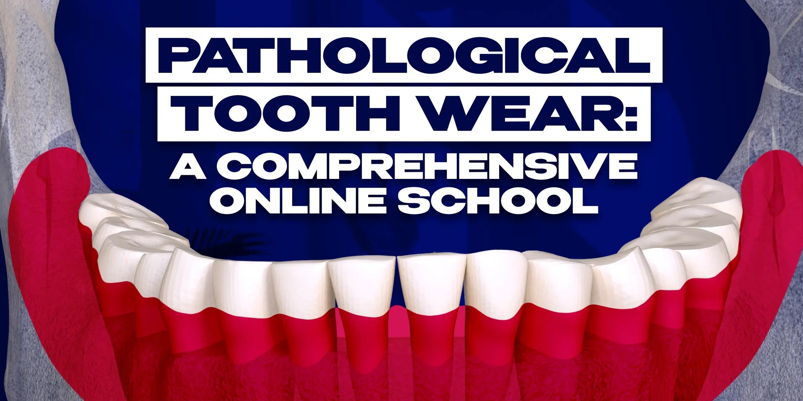 Pathological Tooth Wear Course: Restorative Protocols with Orthlieb & Team