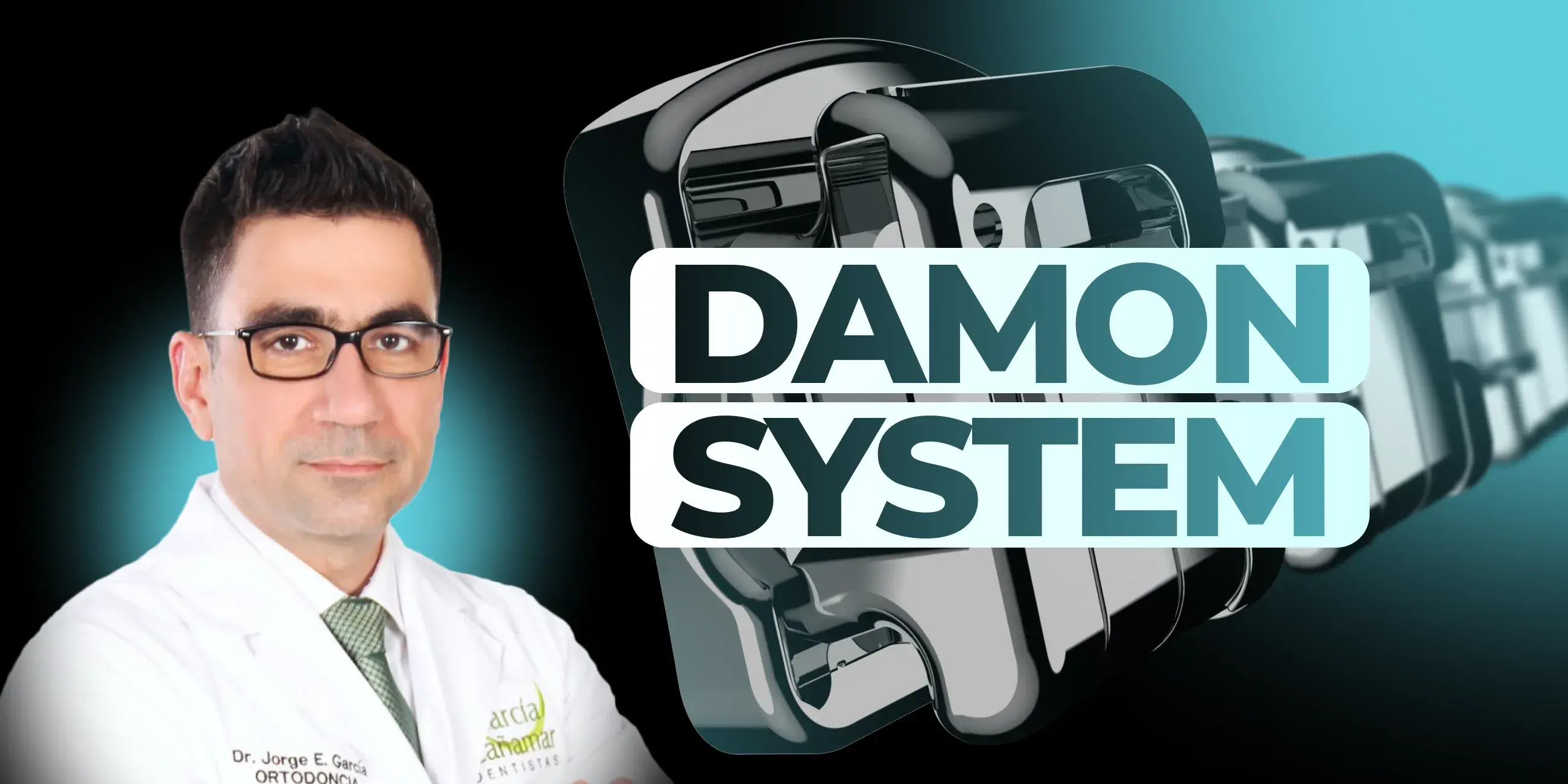 Brackets De Ortodoncia Sistema Damon Orthodontic Treatment In A