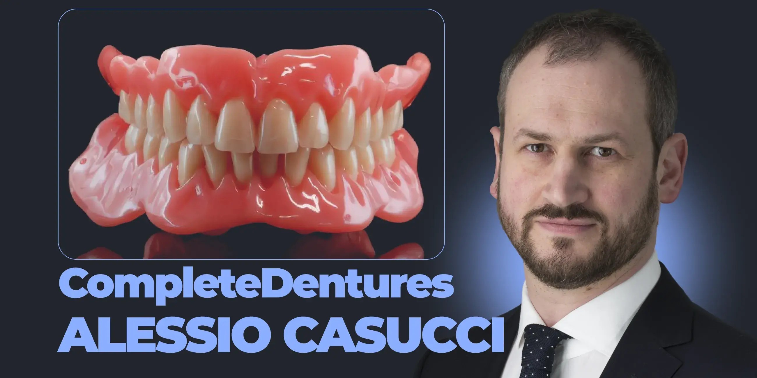 Implant Overdentures: Theory and Clinical Aspects