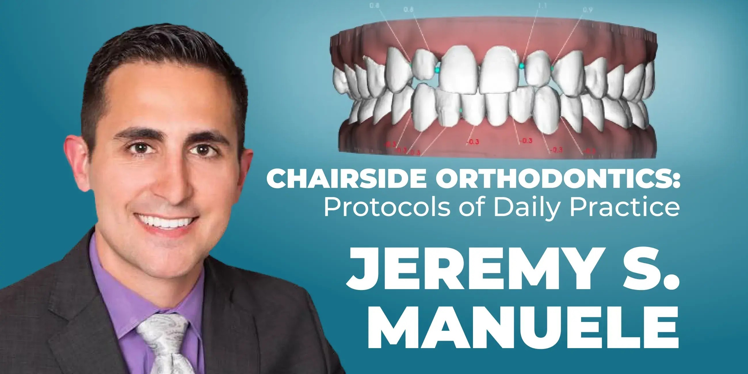 Chairside Refinement Tutorial: Skewed Arch Forms, Open Bite, Slant Cant ...