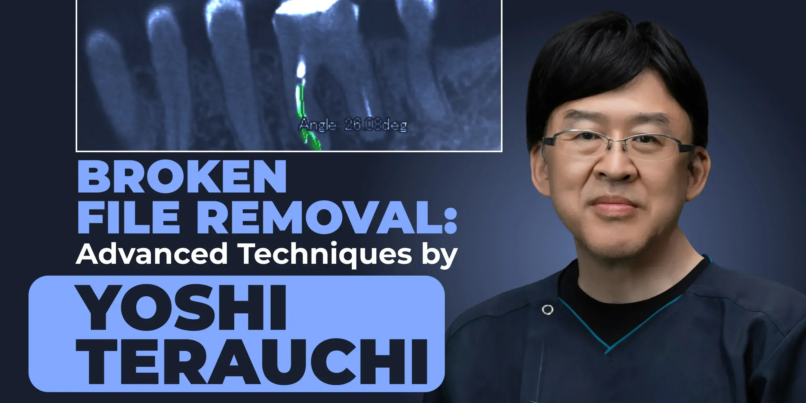 Broken File Removal: Advanced Techniques by Yoshi Terauchi
