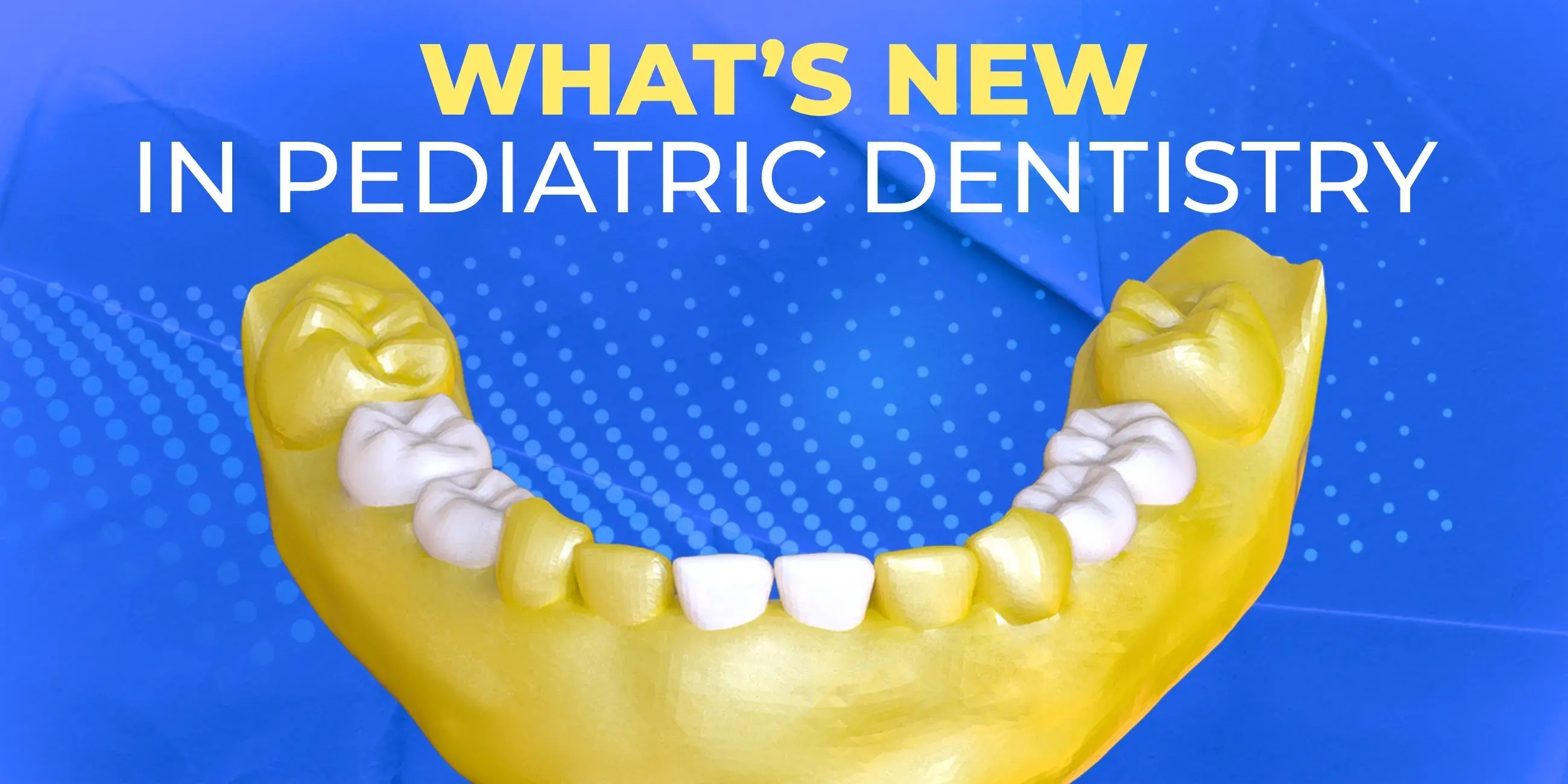 Webinar on endodontic treatment of permanent immature tooth
