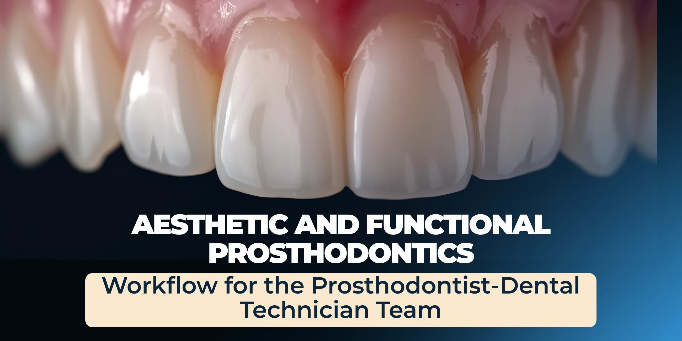 Aesthetic and Functional Prosthodontics. Workflow for the ...
