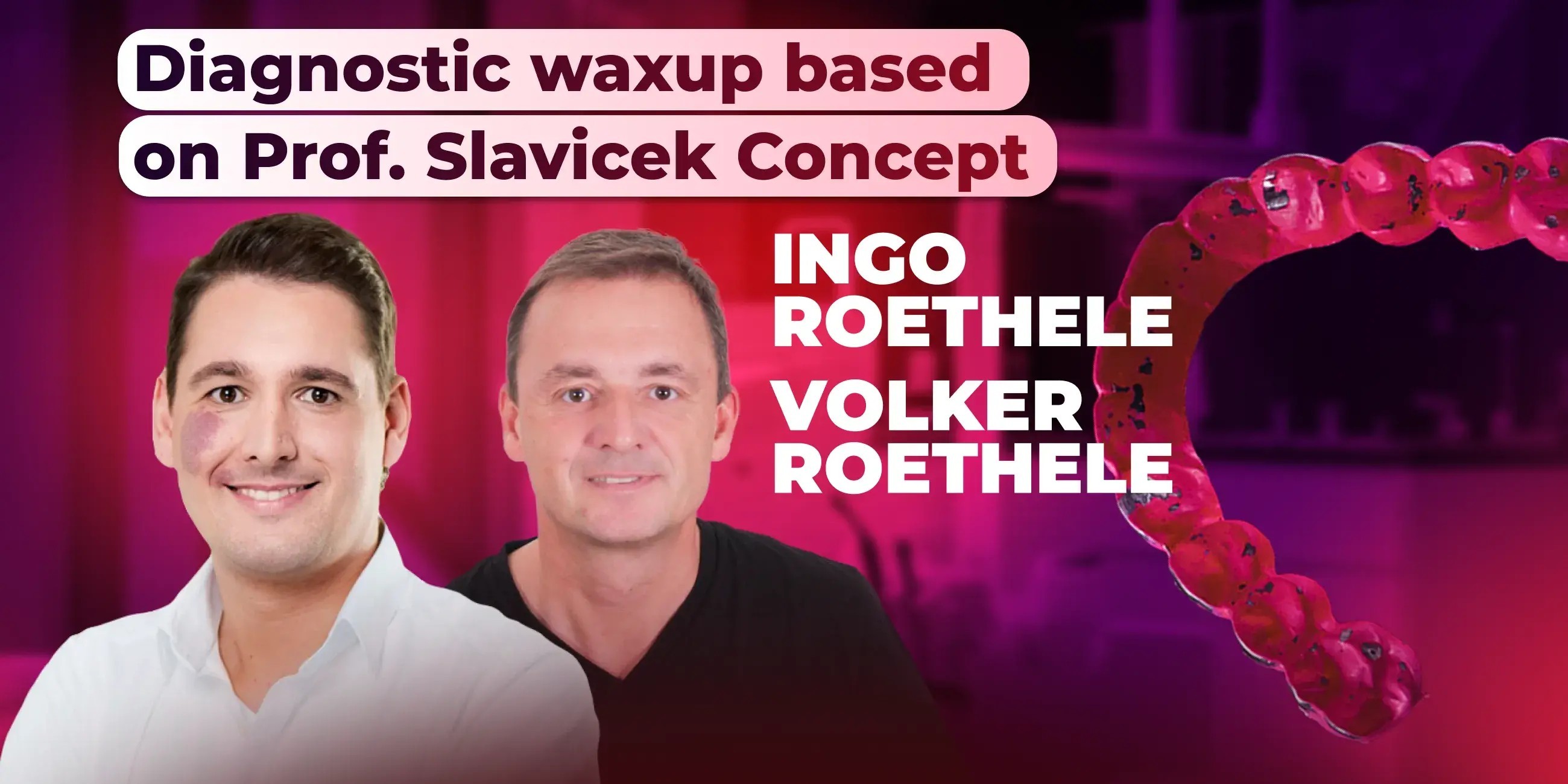 Webinar on programming, settings of the articulator, Wax-up