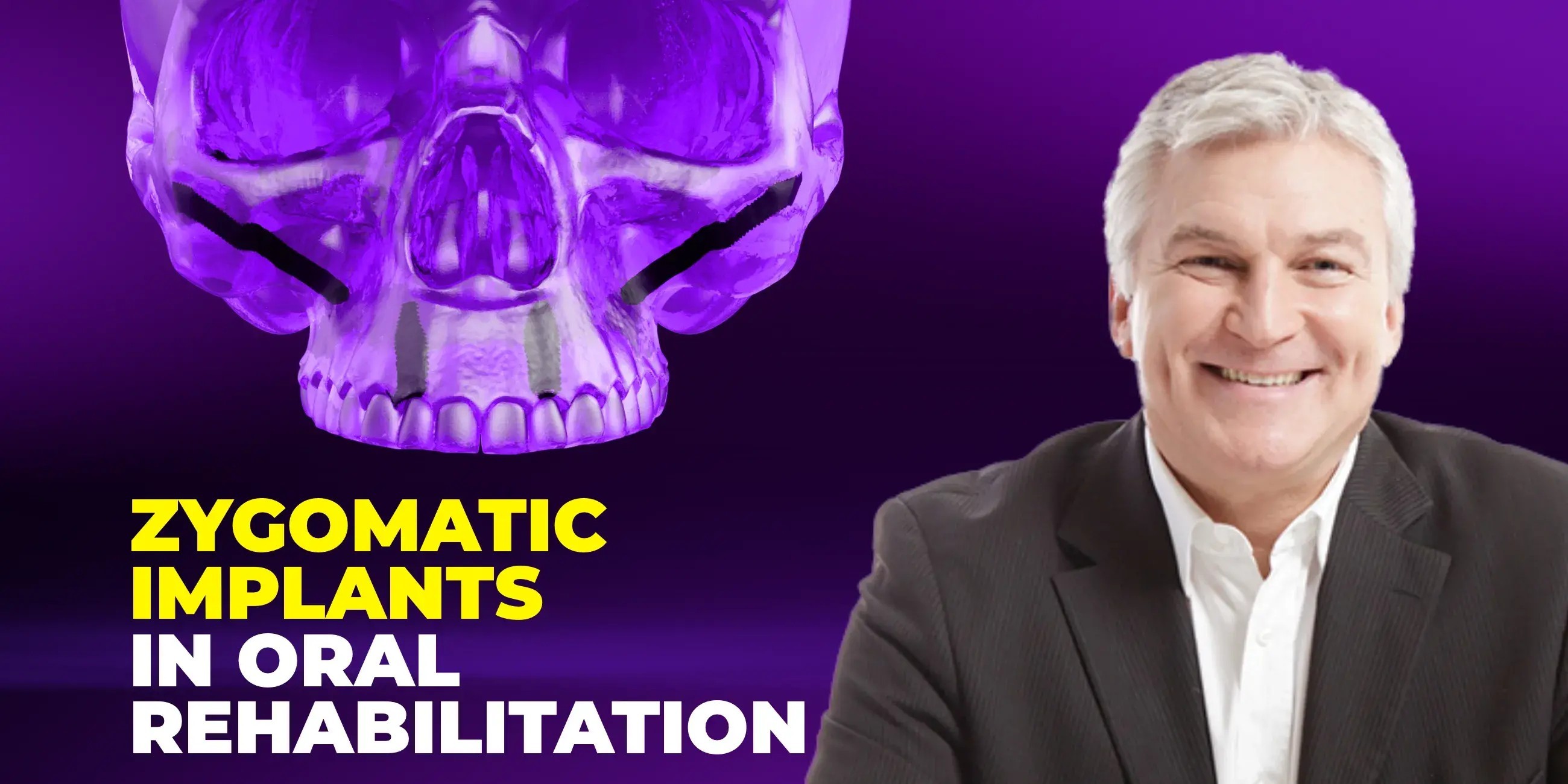 Webinar on Zygoma Full arch rehabilitation, Malo Bridge