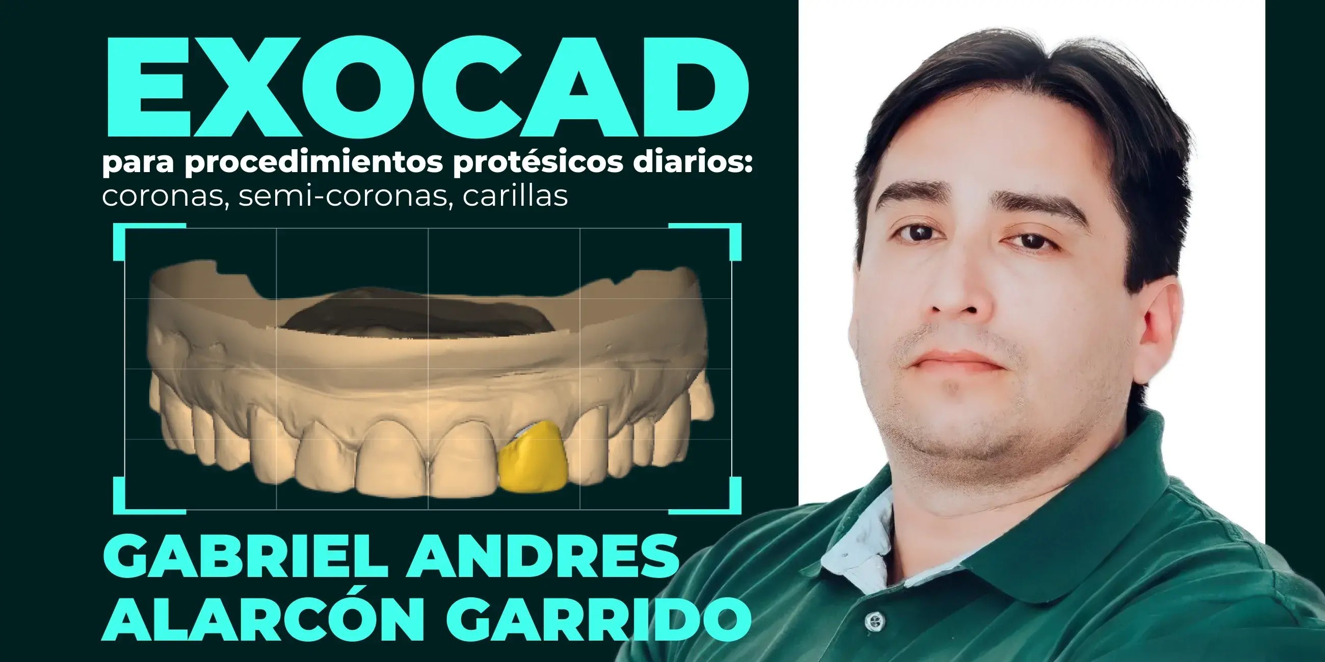 Creación de Prótesis Provisionales y Restauraciones Básicas en EXOCAD