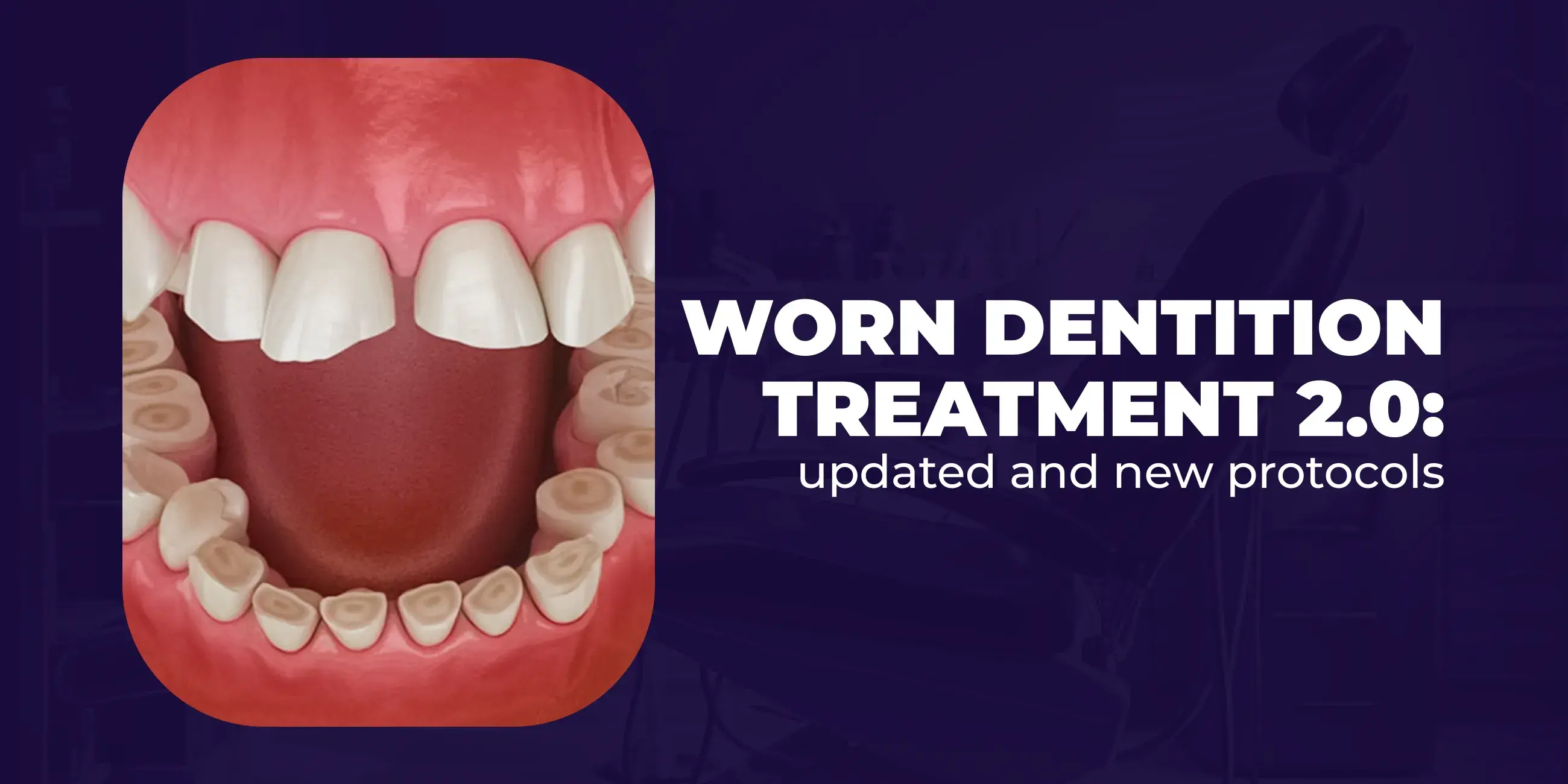 The simple prosthetic approach of tooth wear treatment. DAHL technique