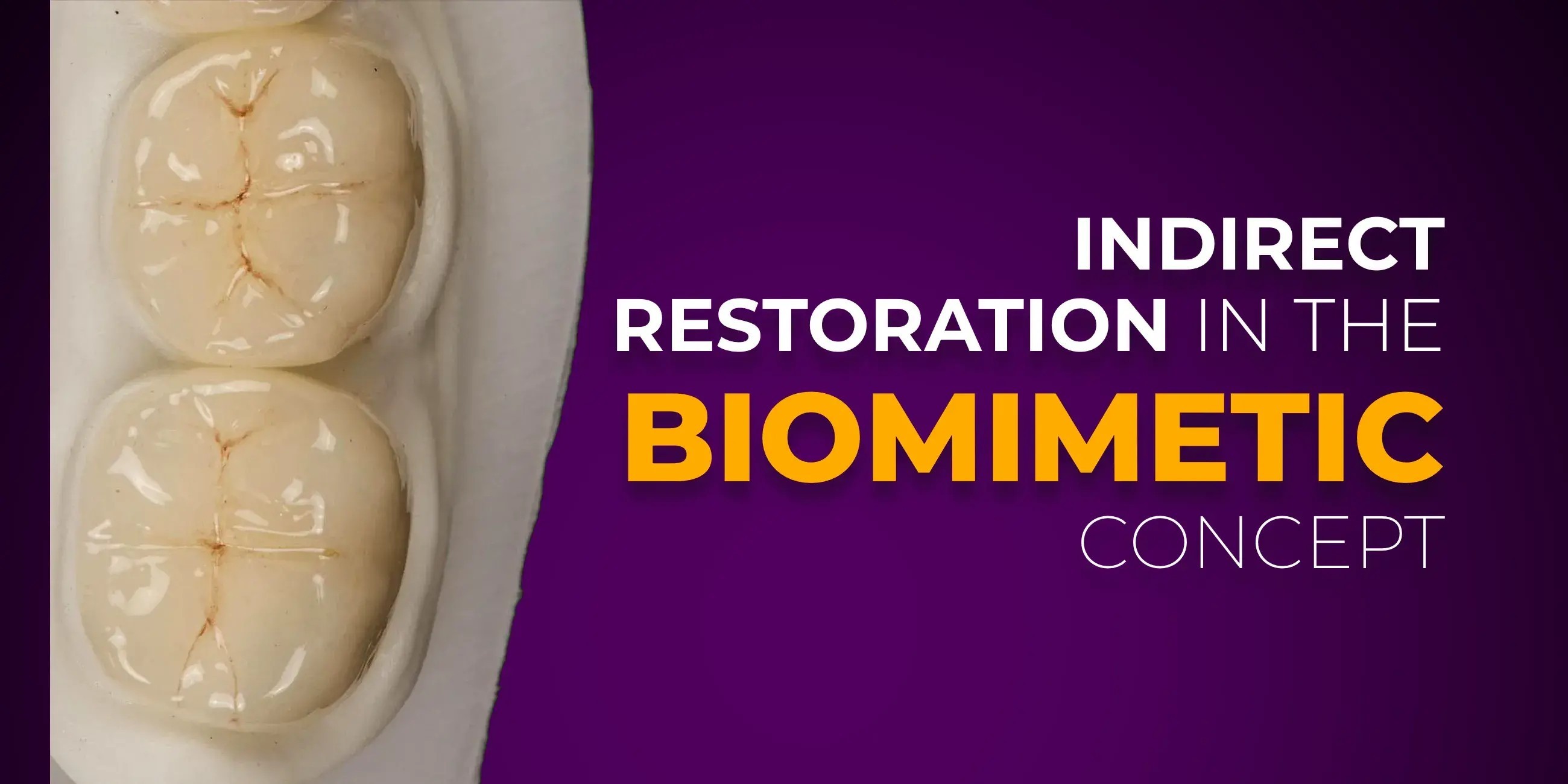 Stress-free restorative dentistry with CAD/CAM partial composite ...