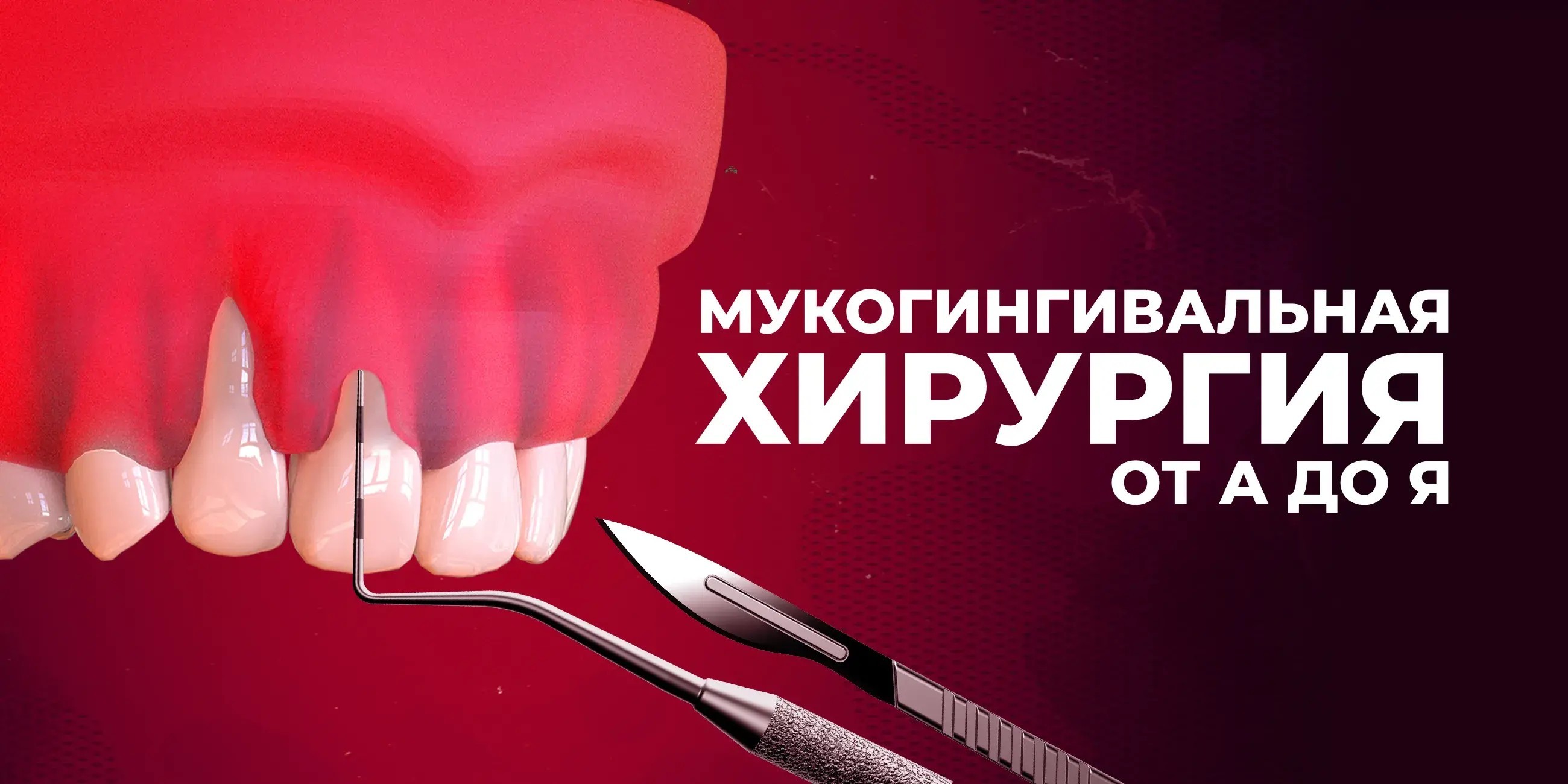 Вебинар - техники забора соединительнотканного трансплантата