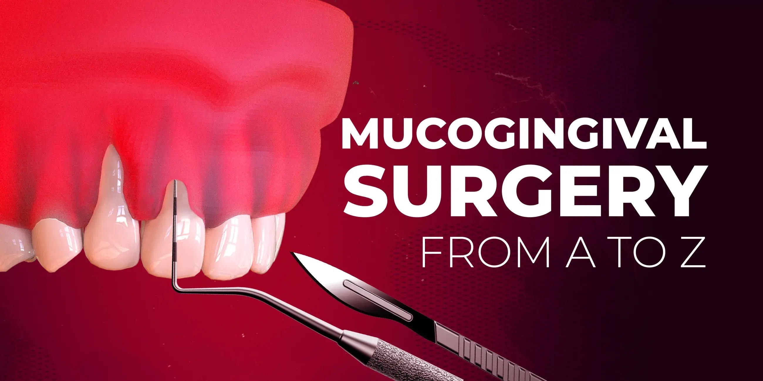 Root coverage: complications and pitfalls. Introductory lesson