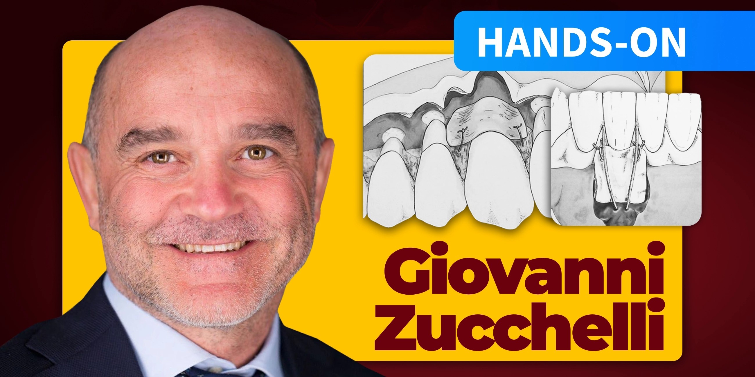 Advanced techniques and management of complication in soft tissue ...