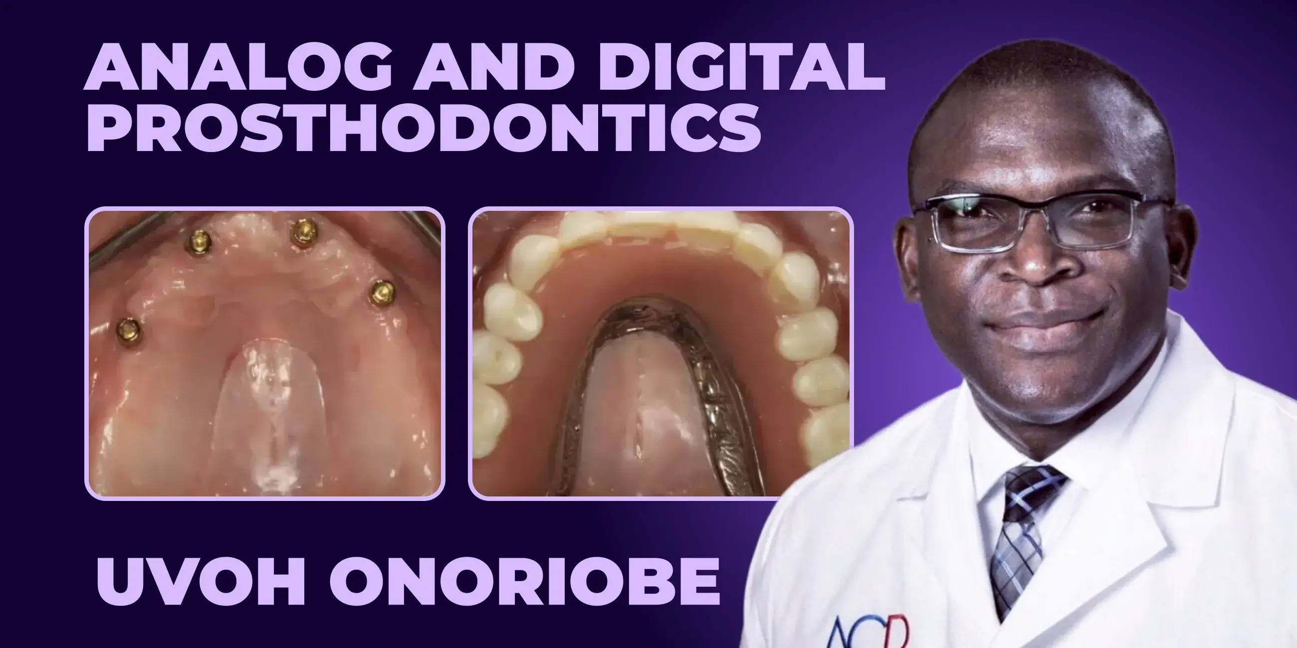 Training on Prosthodontics: vertical preparation, CAD/CAM