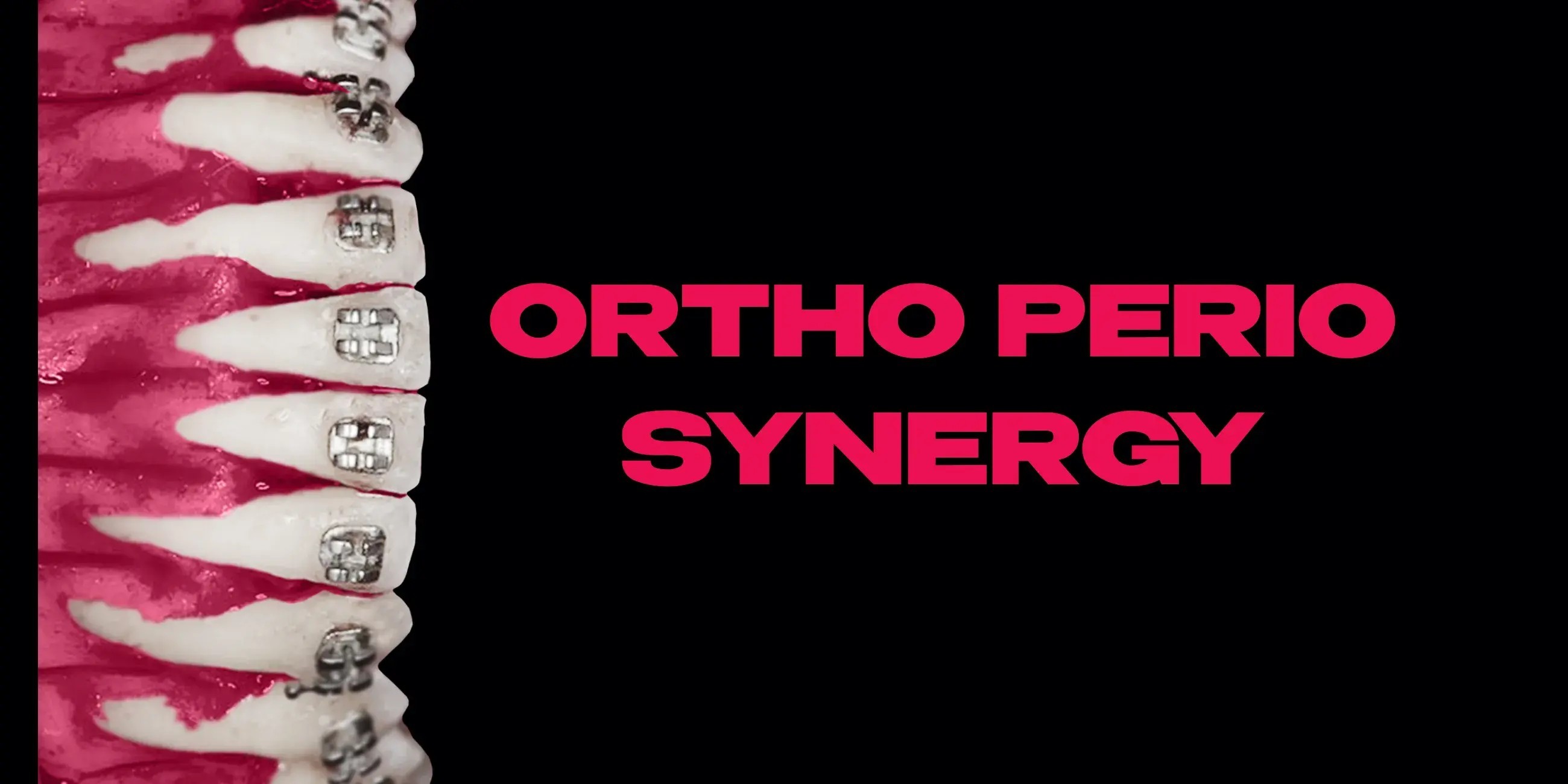 Webinar on diagnosis and ortho-perio therapeutic protocols