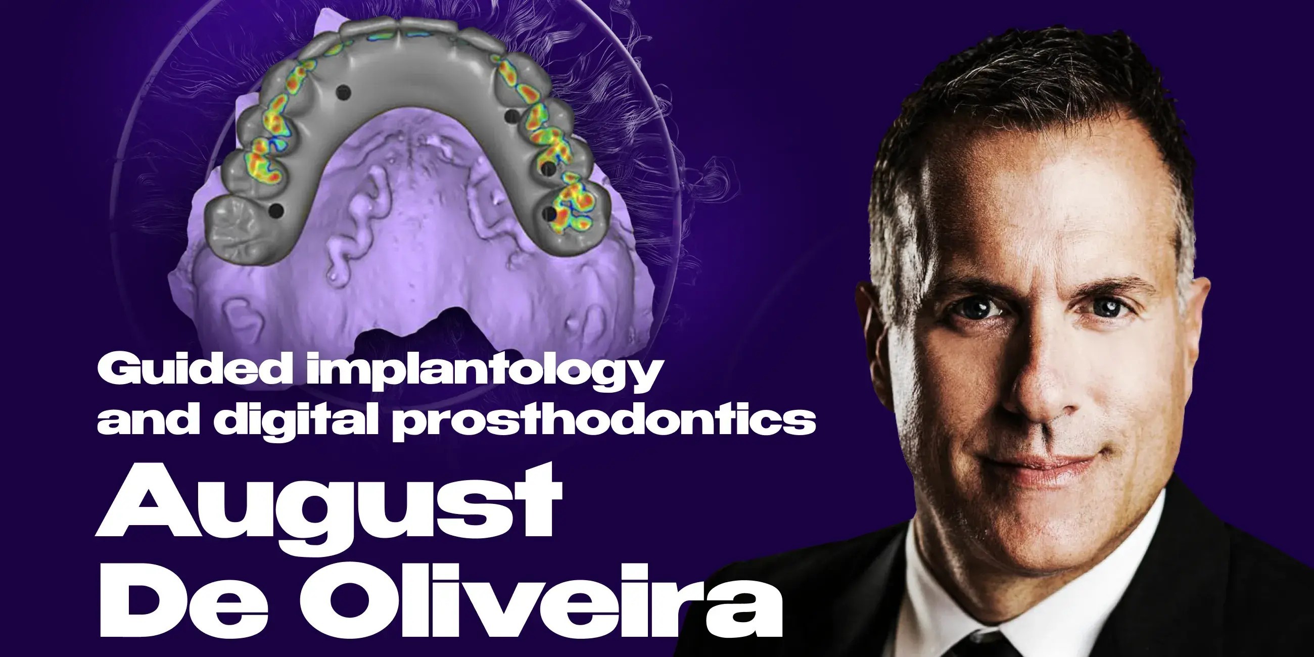 Guided implantology and digital prosthodontics