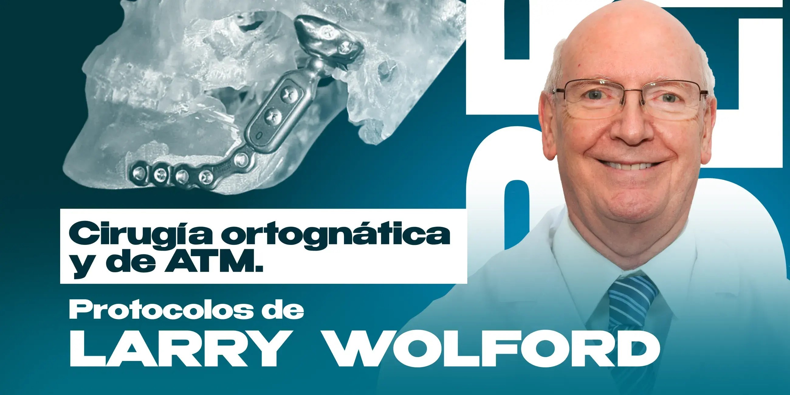 Cirugía de la ATM. Hiperplasia condilar