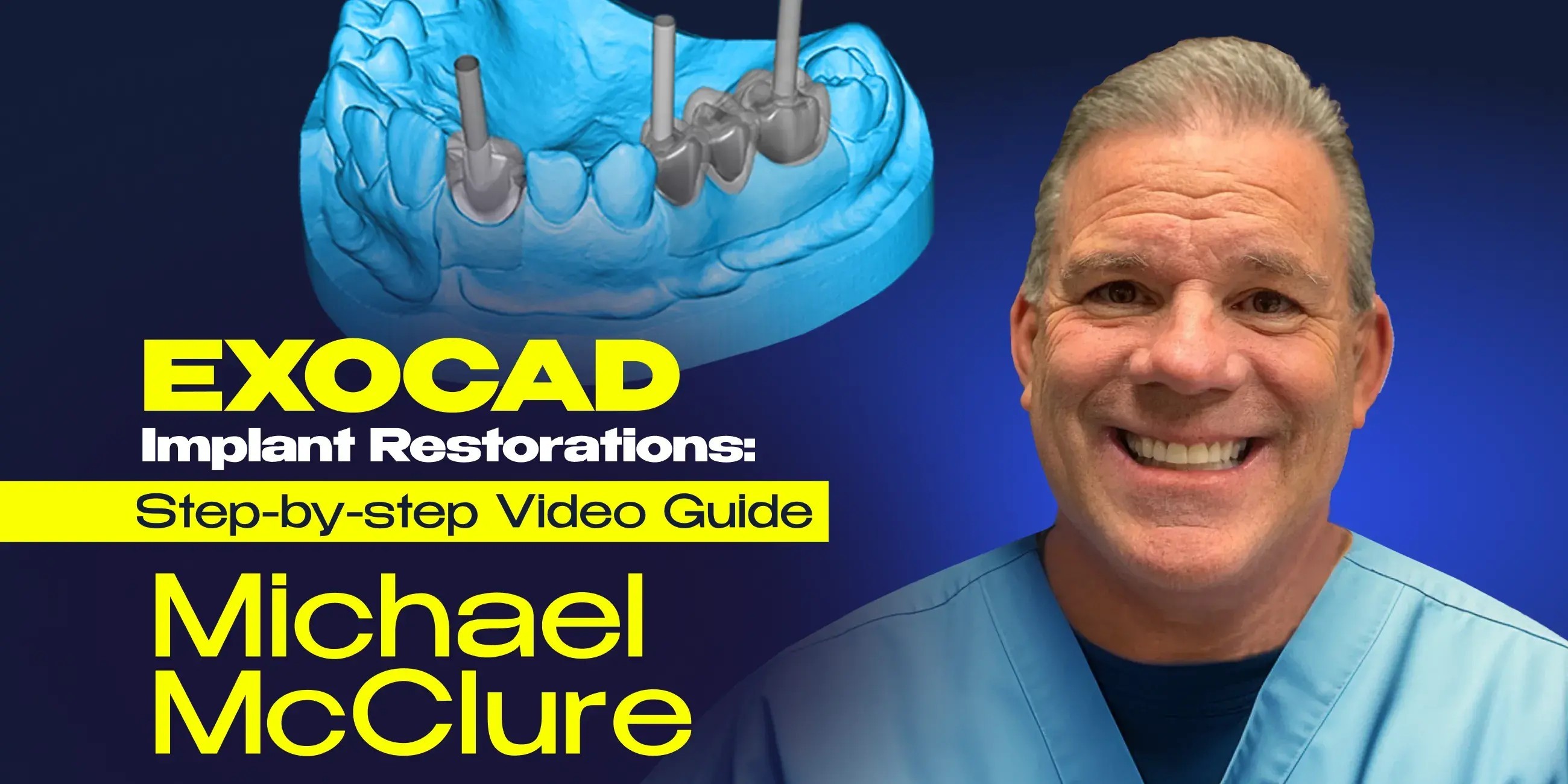 Full Arch Dental Implant retained restorations with Exocad