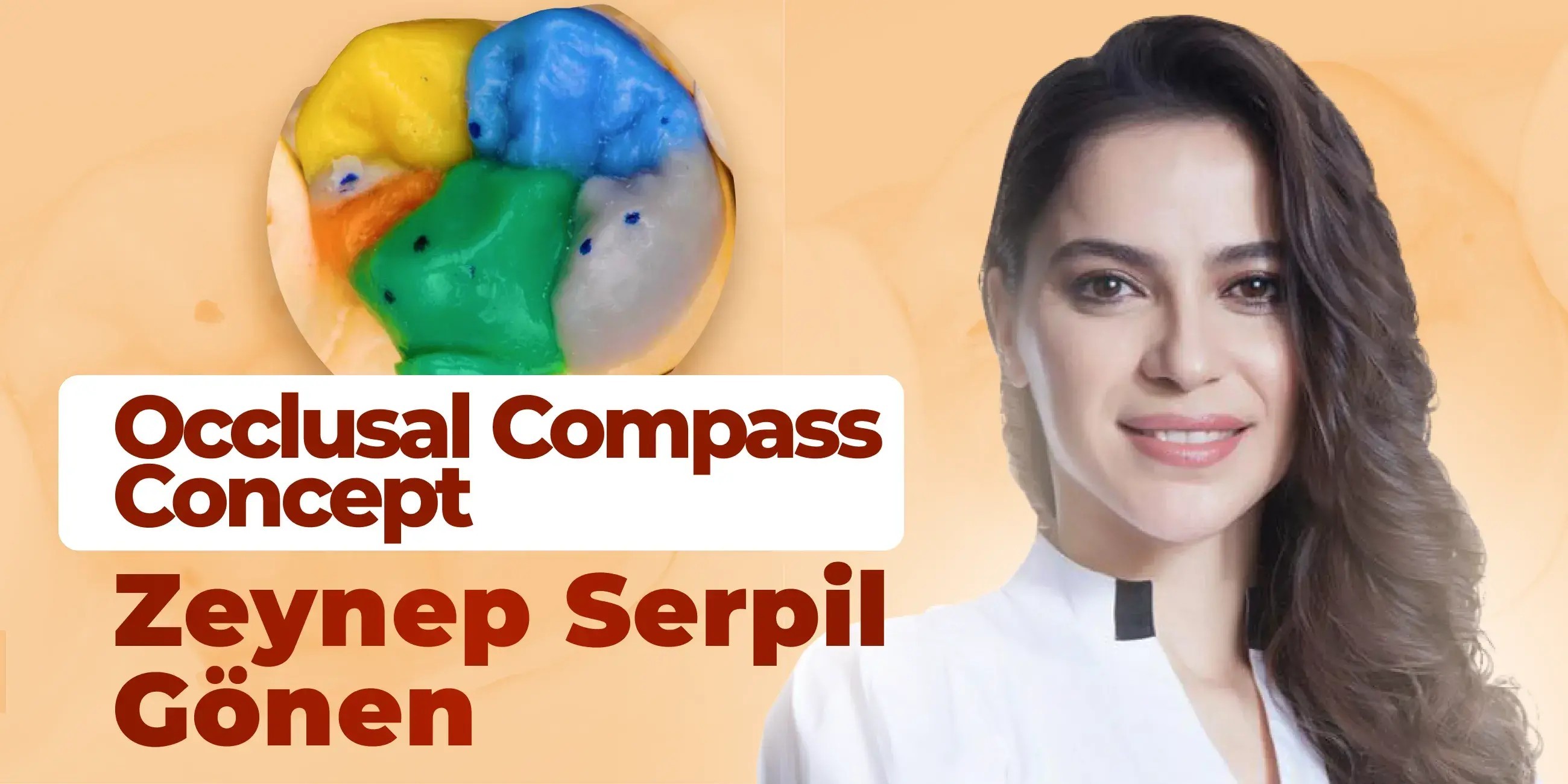 Occlusal Compass Concept: Laboratory Protocols for Functional ...