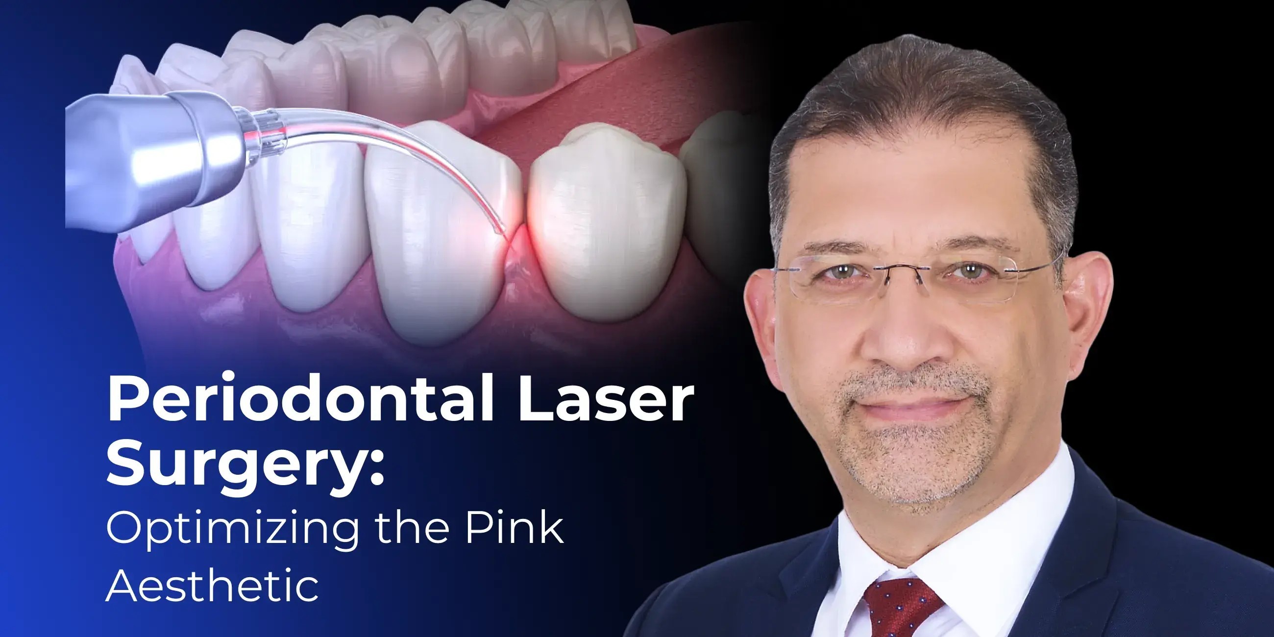 Laser Correction of Short Lingual Frenulum in Children