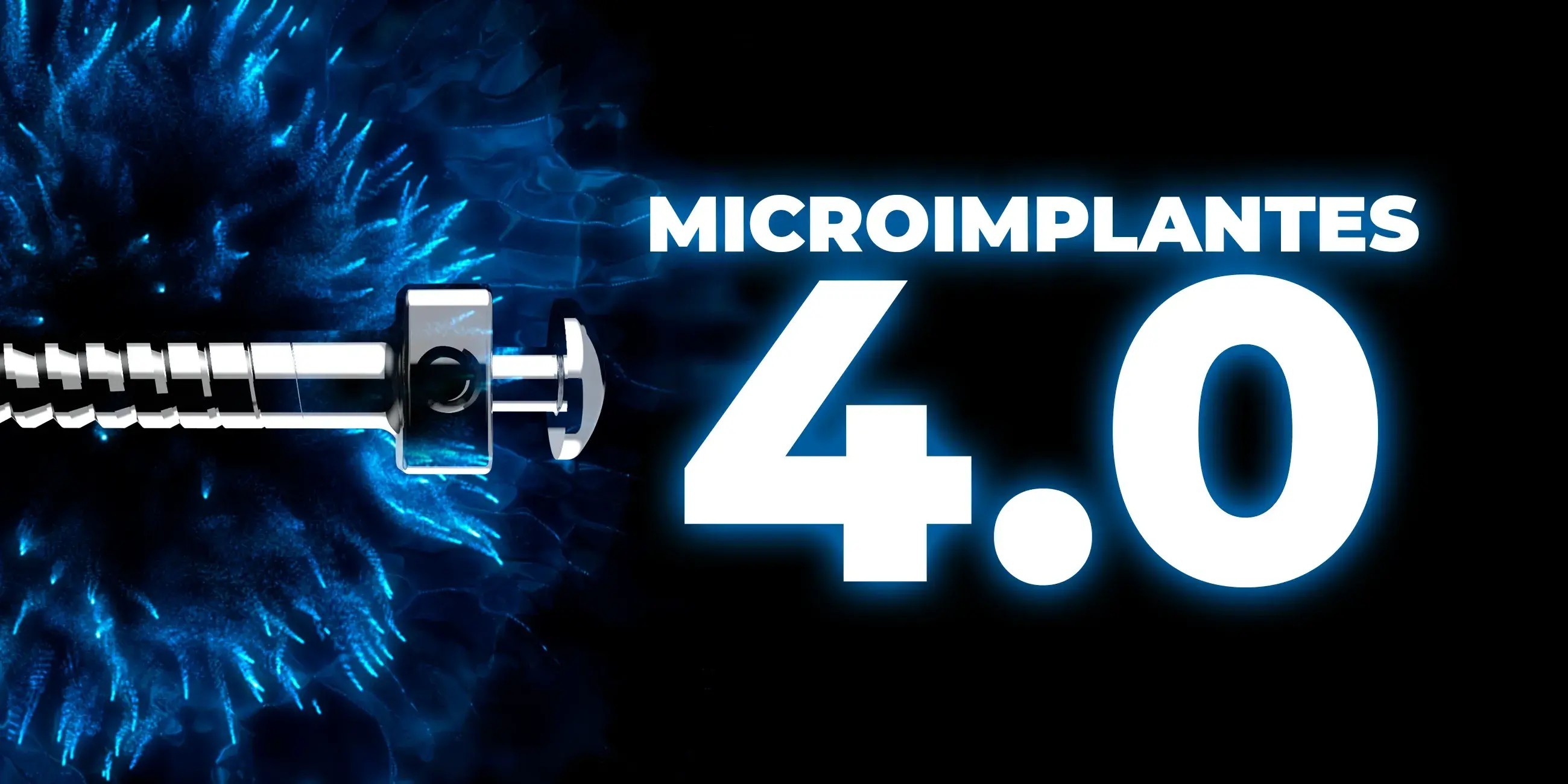 Protocolos simplificados de trabajo con microimplantes en el ...