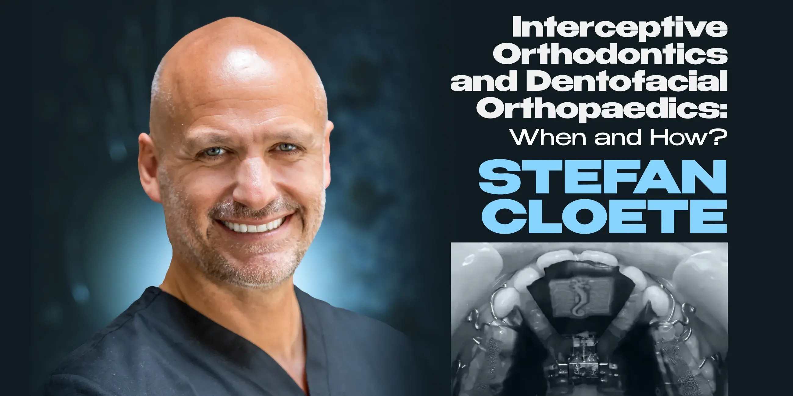 Interceptive Orthodontics & Dentofacial Orthopaedics – 8-Lesson Online ...