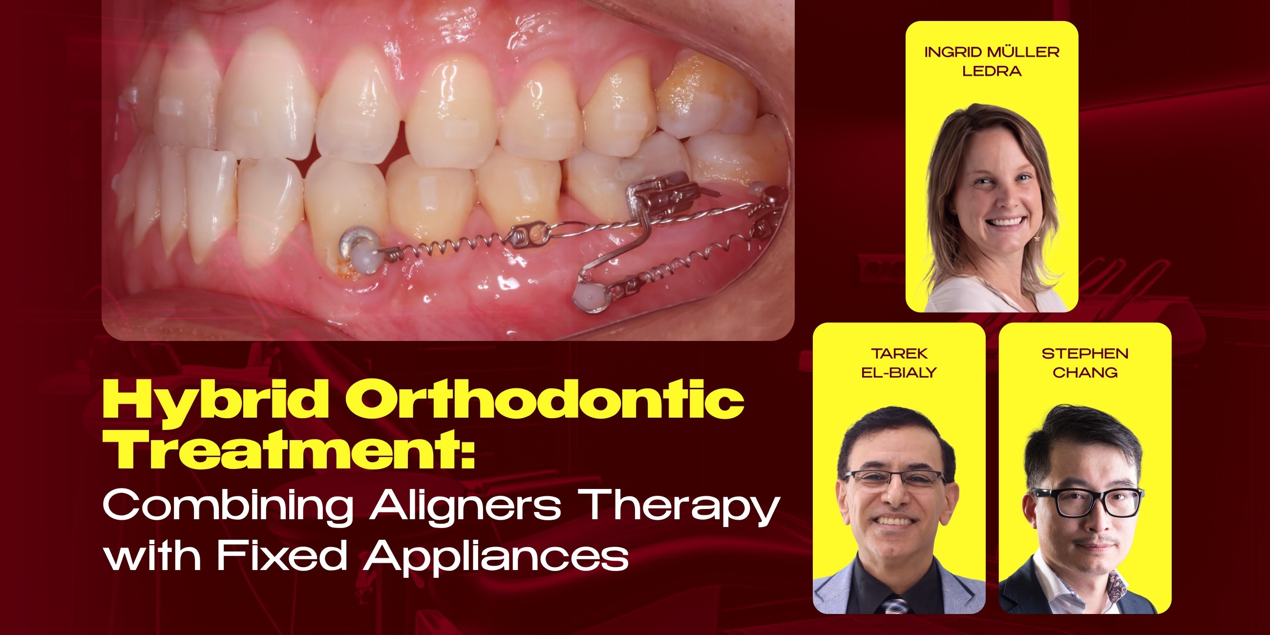Hybrid Orthodontics: Aligners & Fixed Appliances – 6-Lesson Online Course