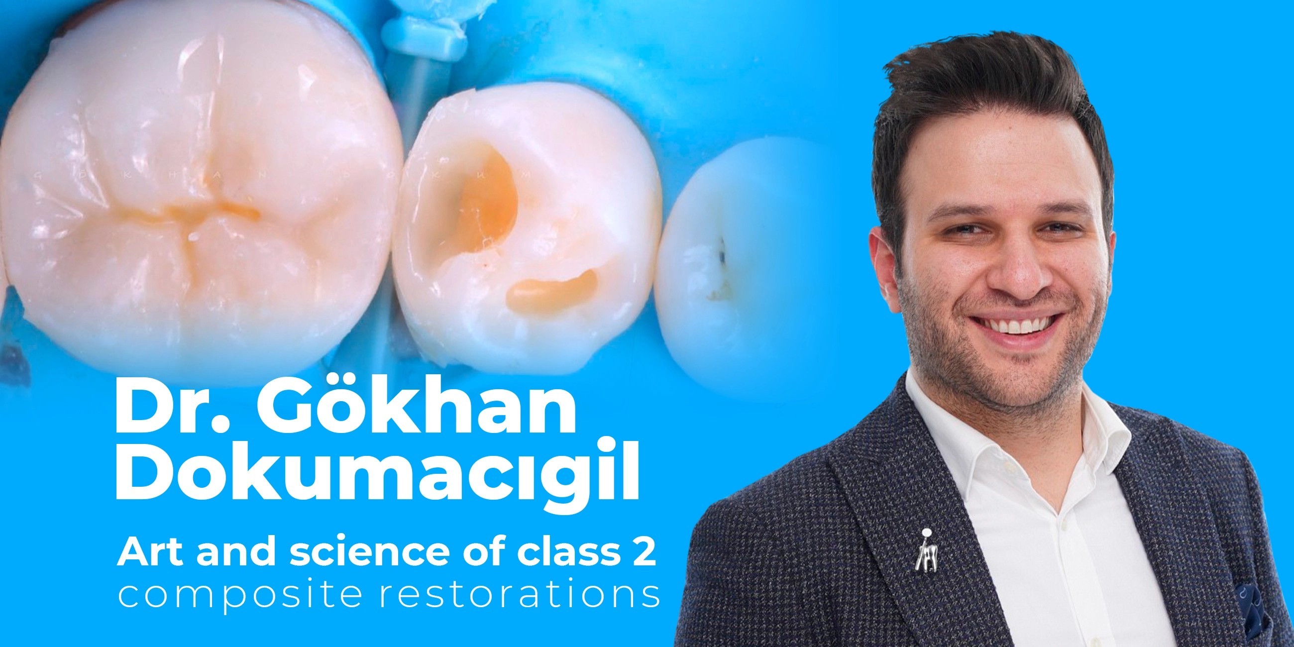 Class 2 restoration protocol