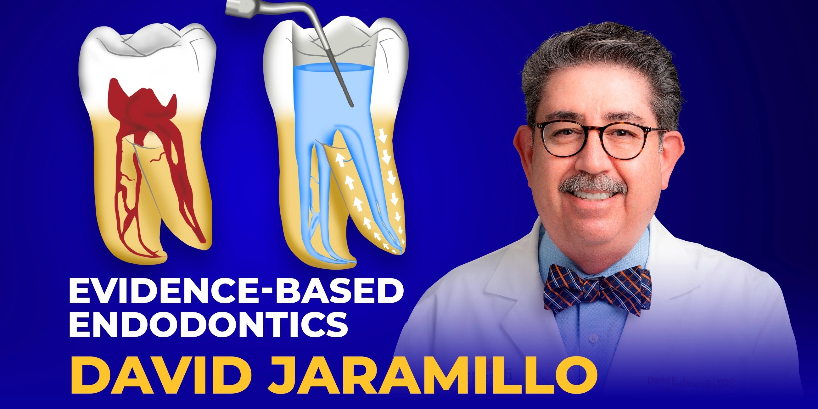 Evidence-Based Endodontics: Complex Histo-analysis and Treatment Protocols