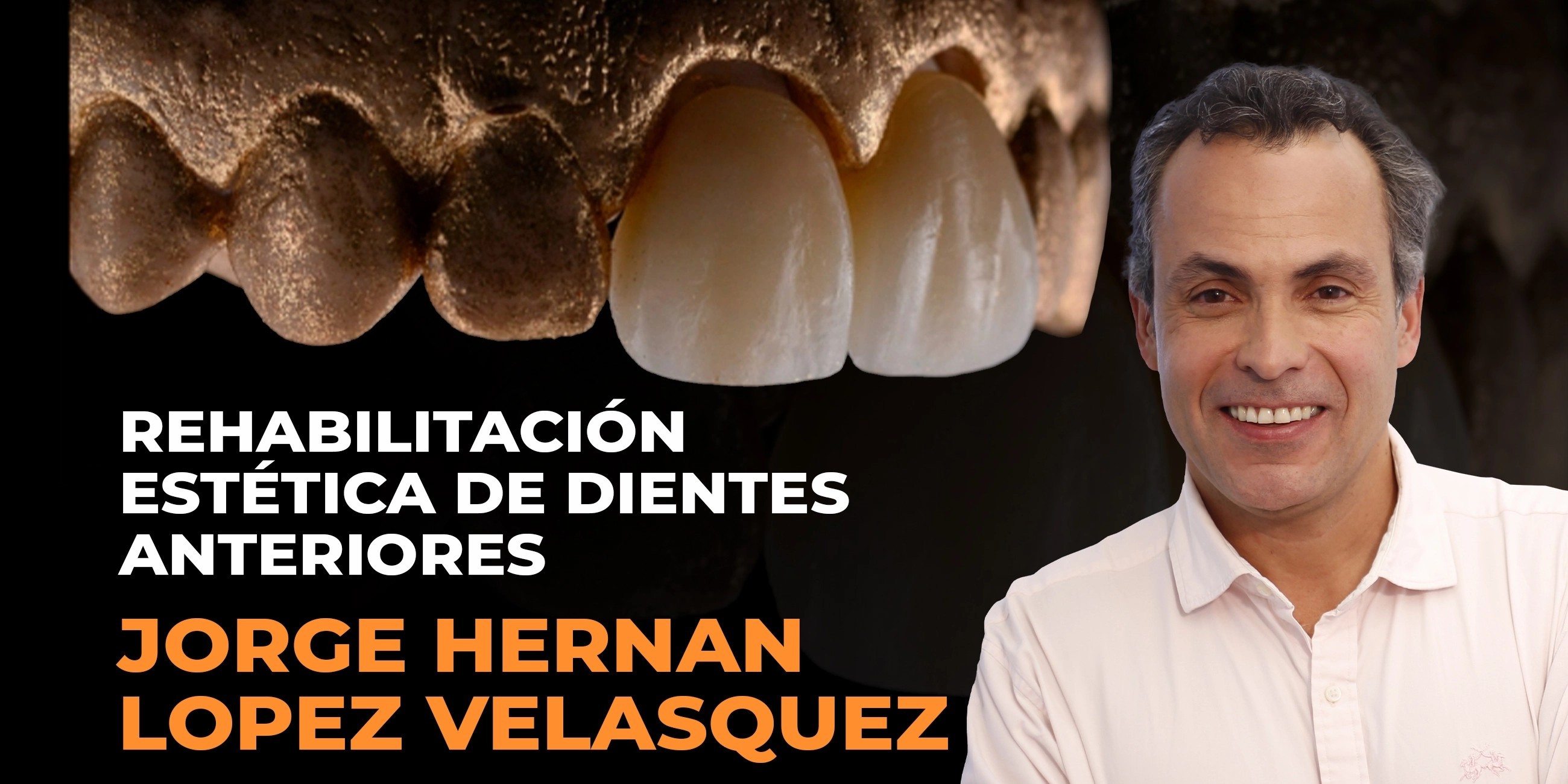 Forma, color y propiedades ópticas de los dientes naturales. Lección ...