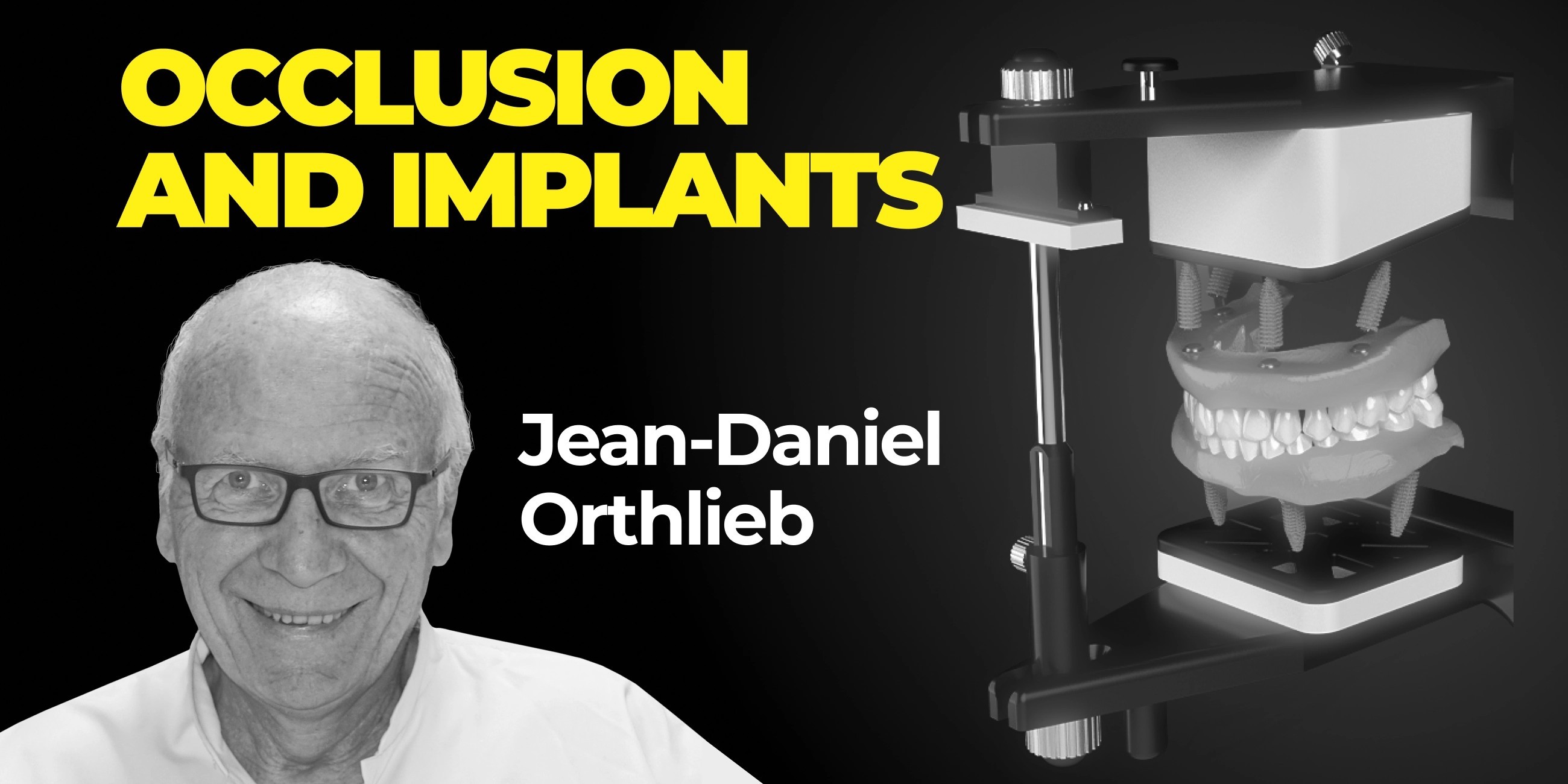 Occlusion on implants, Jean-Daniel Orthlieb online webinar