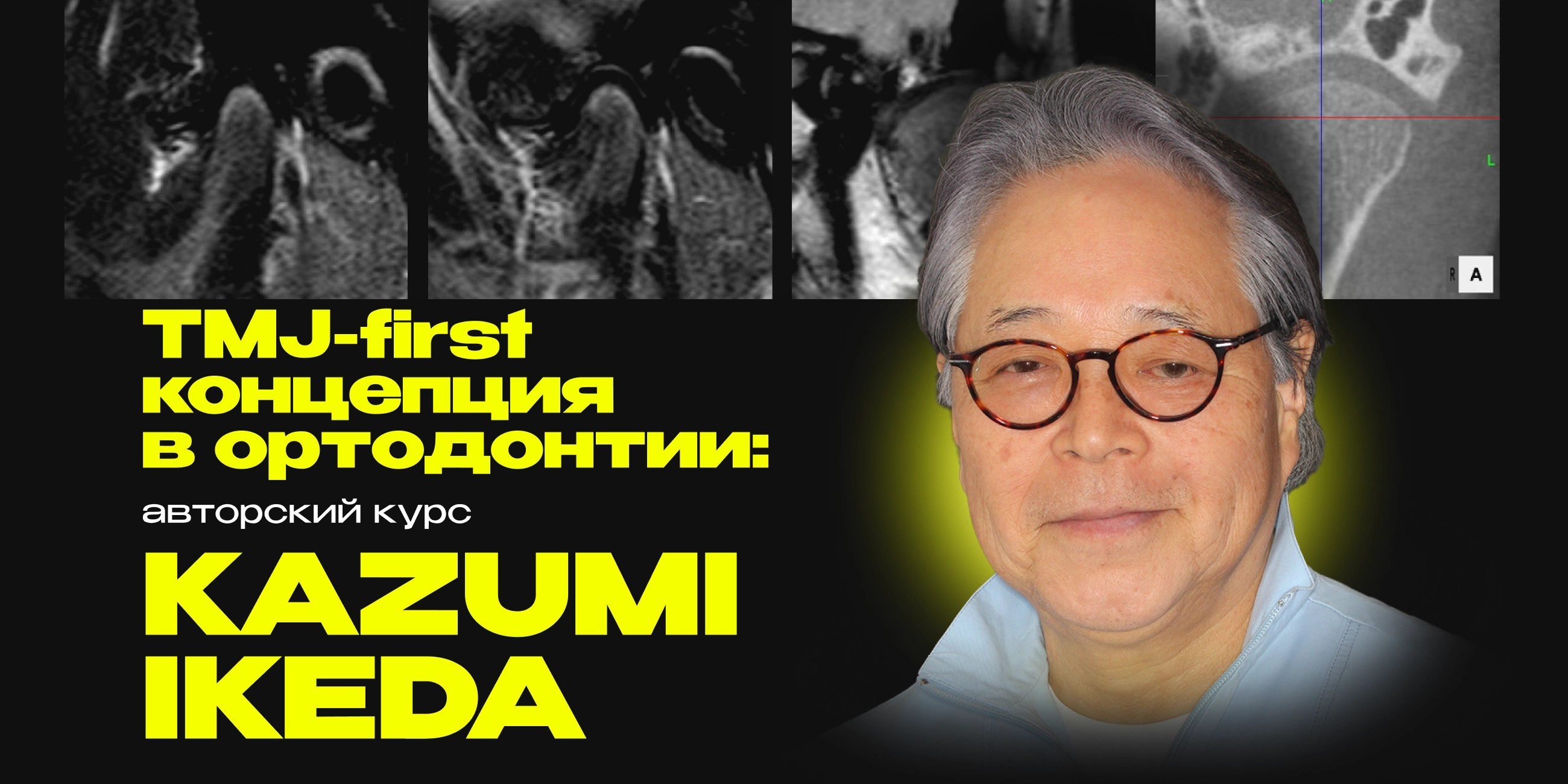 TMJ-first концепция в ортодонтии: авторский курс Kazumi Ikeda