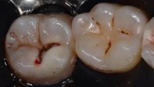 Direct composite reconstruction of the morphology and anatomy in a ...