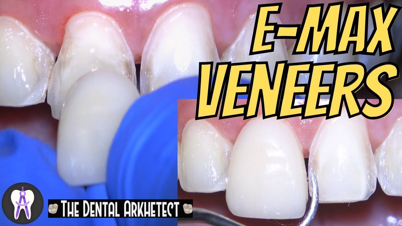 OHI S Dental Portal